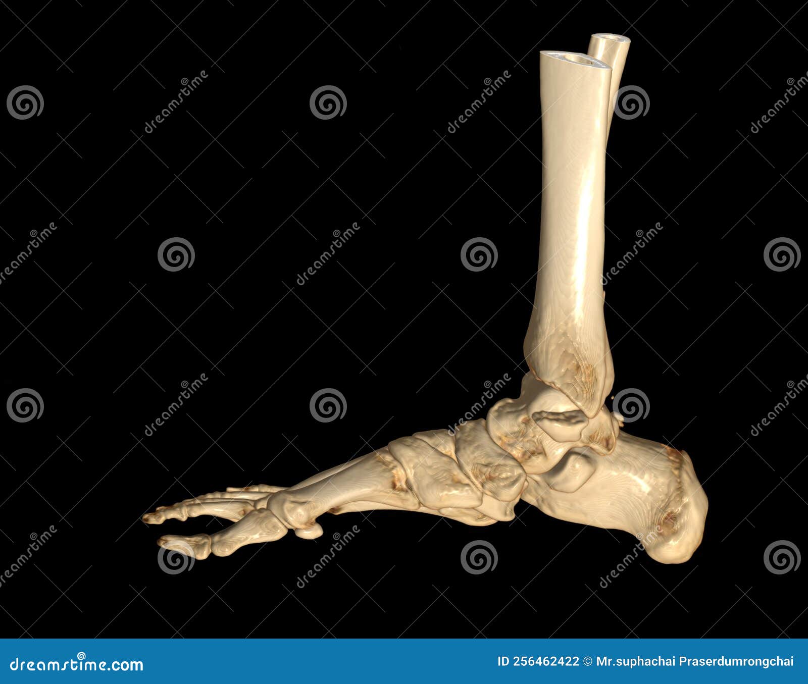 CT Scan Ankle And Foot Or Computed Tomography Of Ankle Joint And Foot ... CT Scan Ankle And Foot Or Computed Tomography Of Ankle Joint And Foot ...