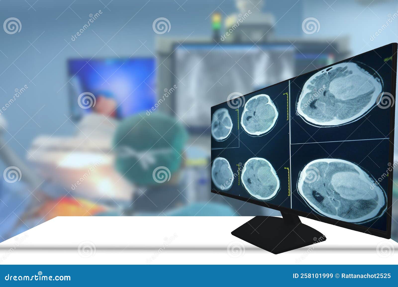CT Scan Brain Finding Isodense Mass with Ill-defined Margin and ... CT Scan Brain Finding Isodense Mass with Ill-defined Margin and ...