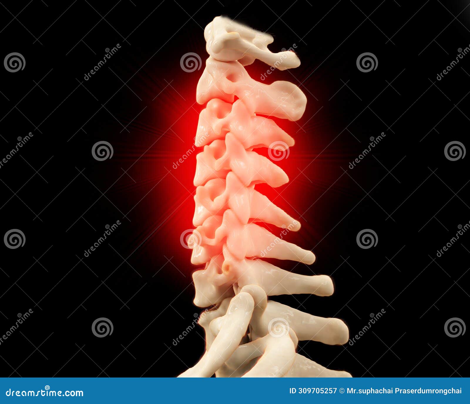 CT SCAN Of Cervical Spine C-spine Stock Photography | CartoonDealer.com ... CT SCAN Of Cervical Spine C-spine Stock Photography | CartoonDealer.com ...