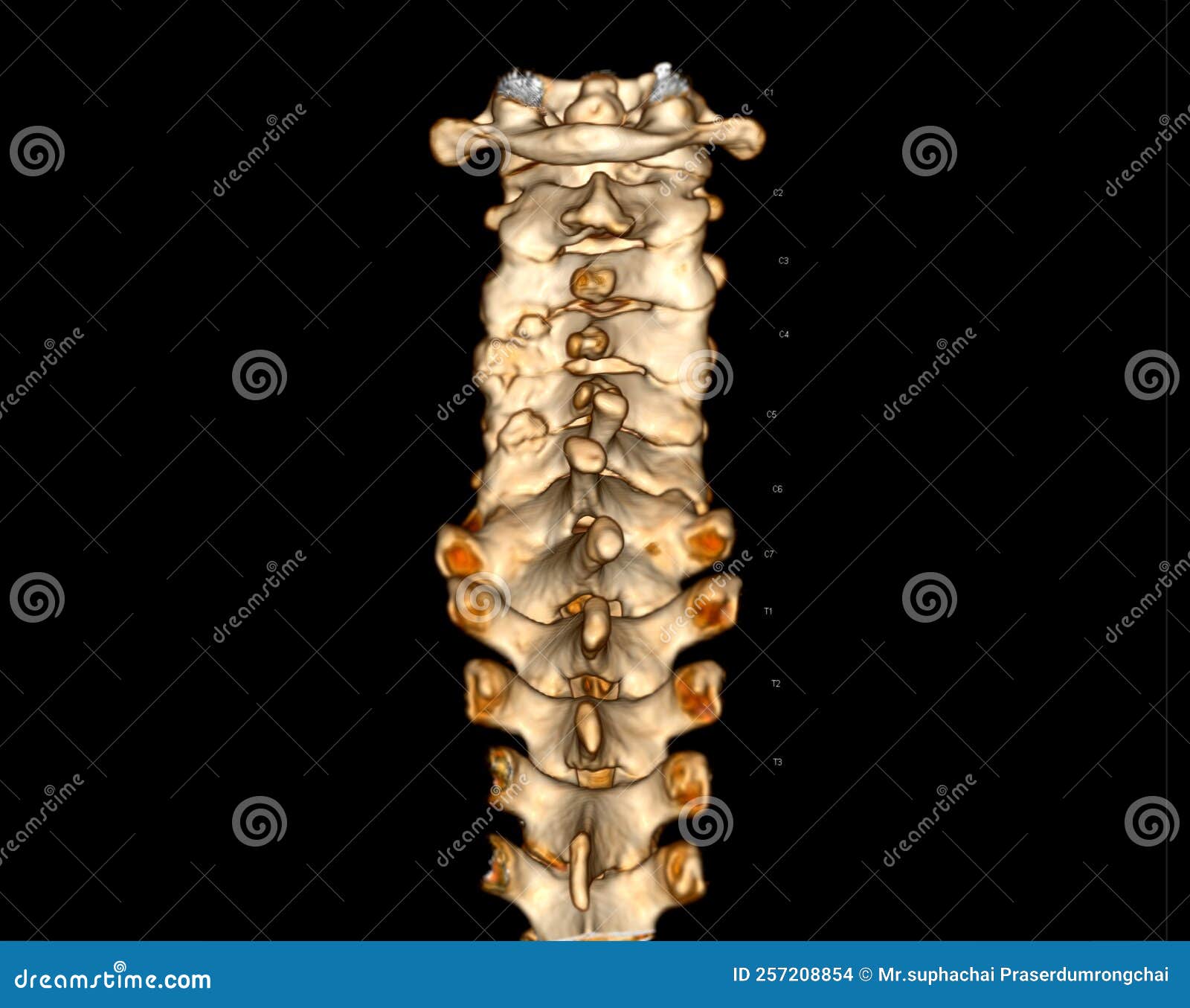Ct Scan Of C Spine Or Cervical Spine 3d Rendering Stock Illustration