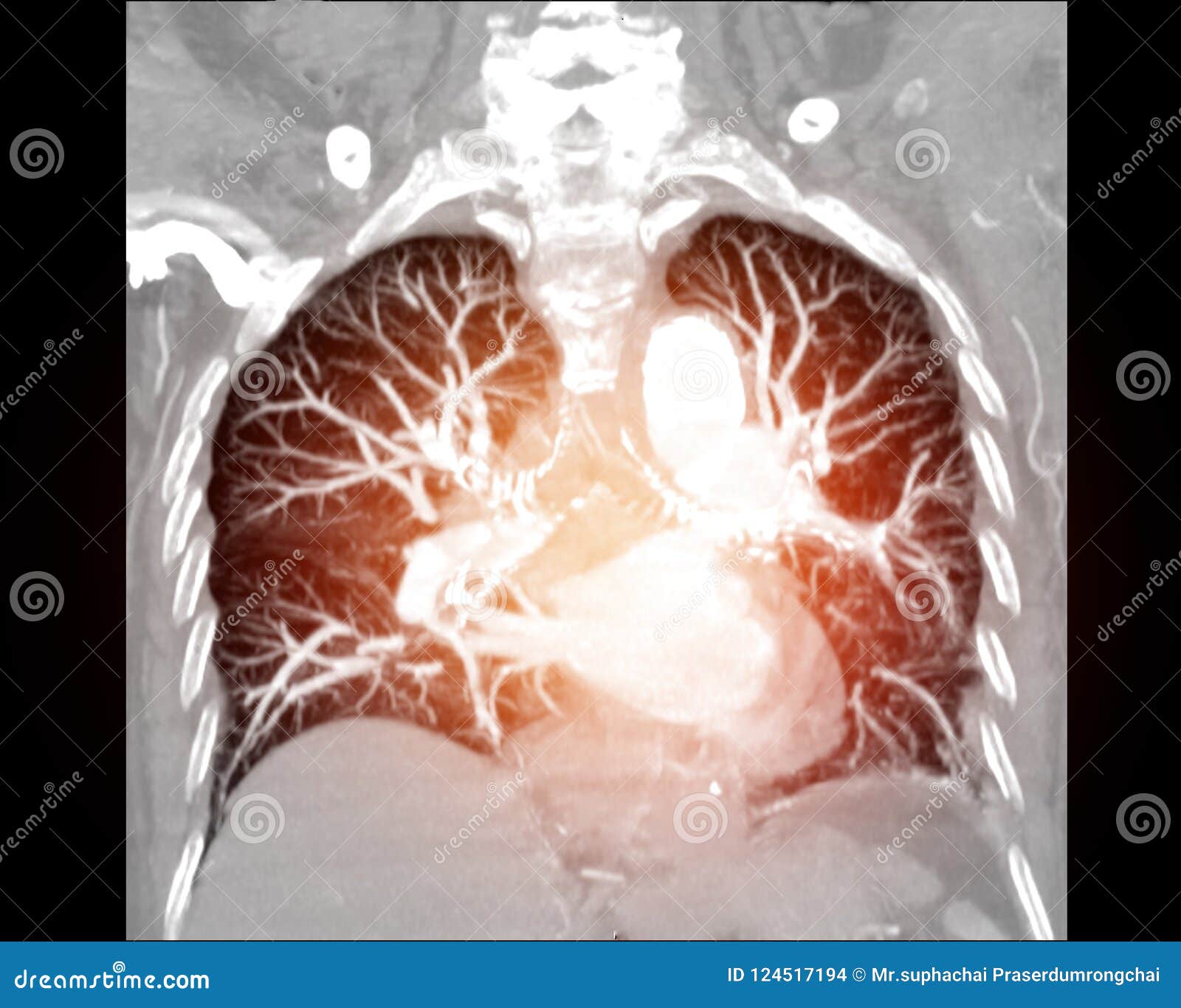 CT SCAN 2D and 3D Rendering of Lower Extremity. Stock Photo - Image of ... CT SCAN 2D and 3D Rendering of Lower Extremity. Stock Photo - Image of ...