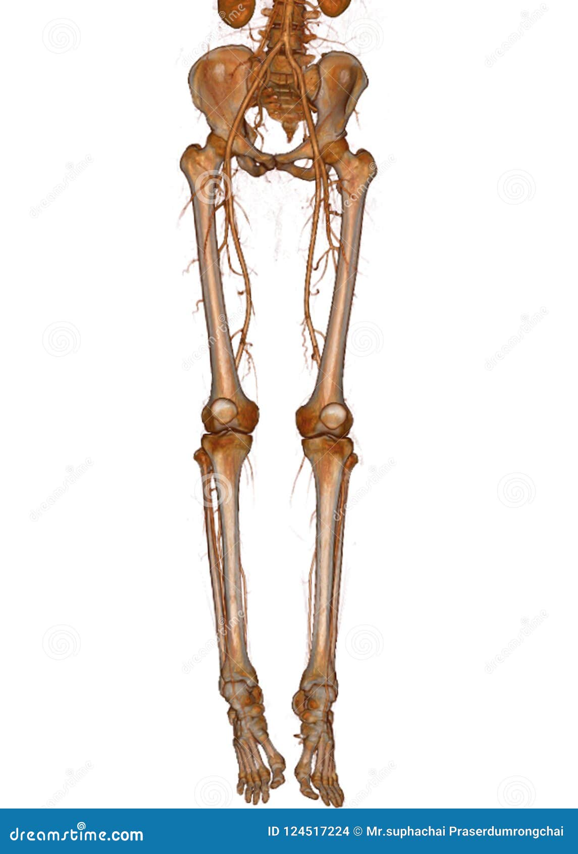 CT SCAN 3D Rendering Image of Lower Extremity. Stock Illustration ... CT SCAN 3D Rendering Image of Lower Extremity. Stock Illustration ...