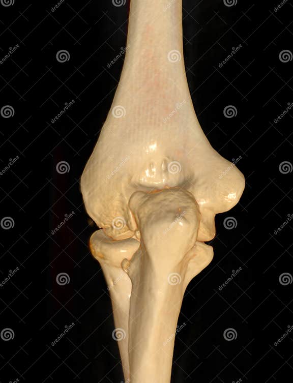 CT Scan of Elbow Joint 3d Rendering Stock Illustration - Illustration ...