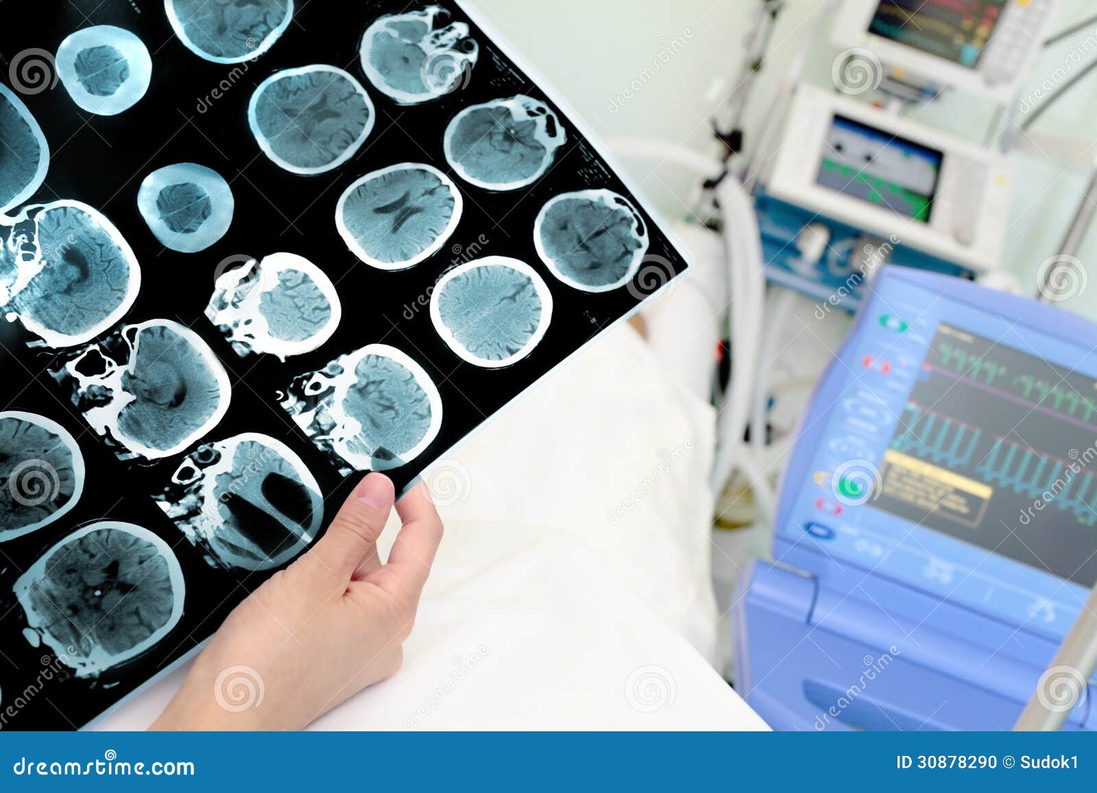 CT scan of the head stock photo. Image of hand, cancer - 30878290