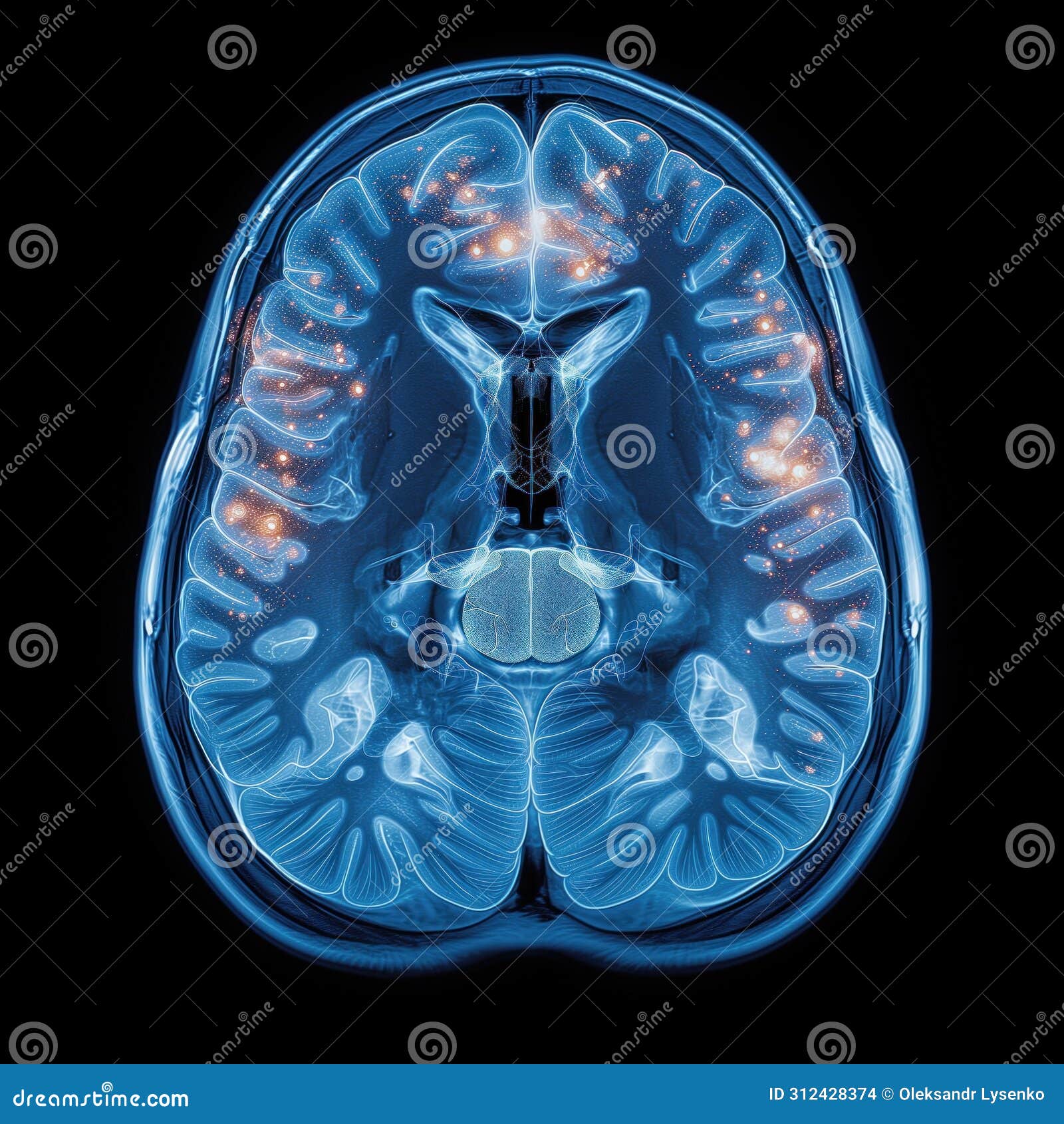CT Scan of Human Brain Digital Image Stock Illustration - Illustration ...