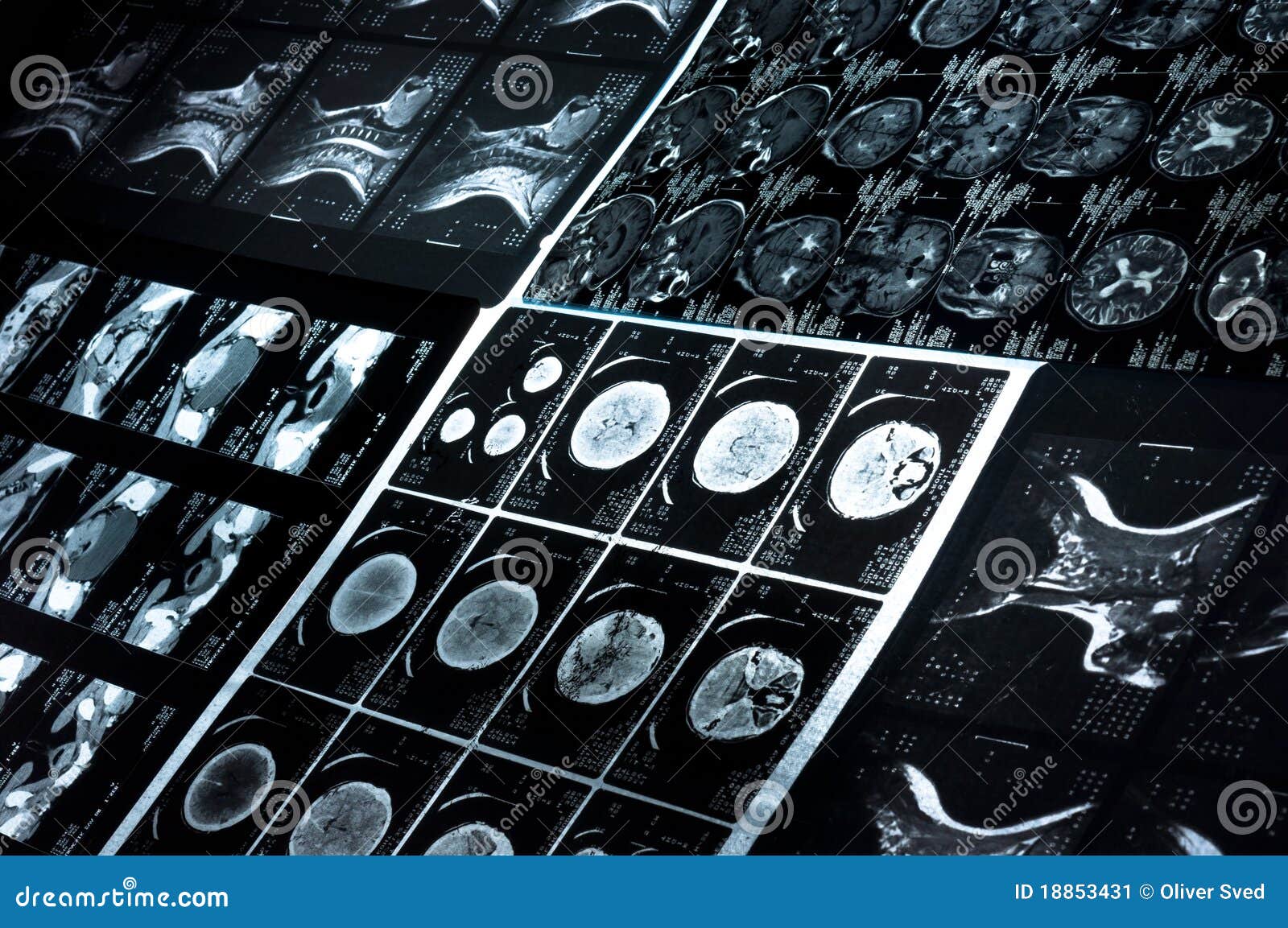 CT Scan And MRI Images Royalty-Free Stock Photo | CartoonDealer.com ...