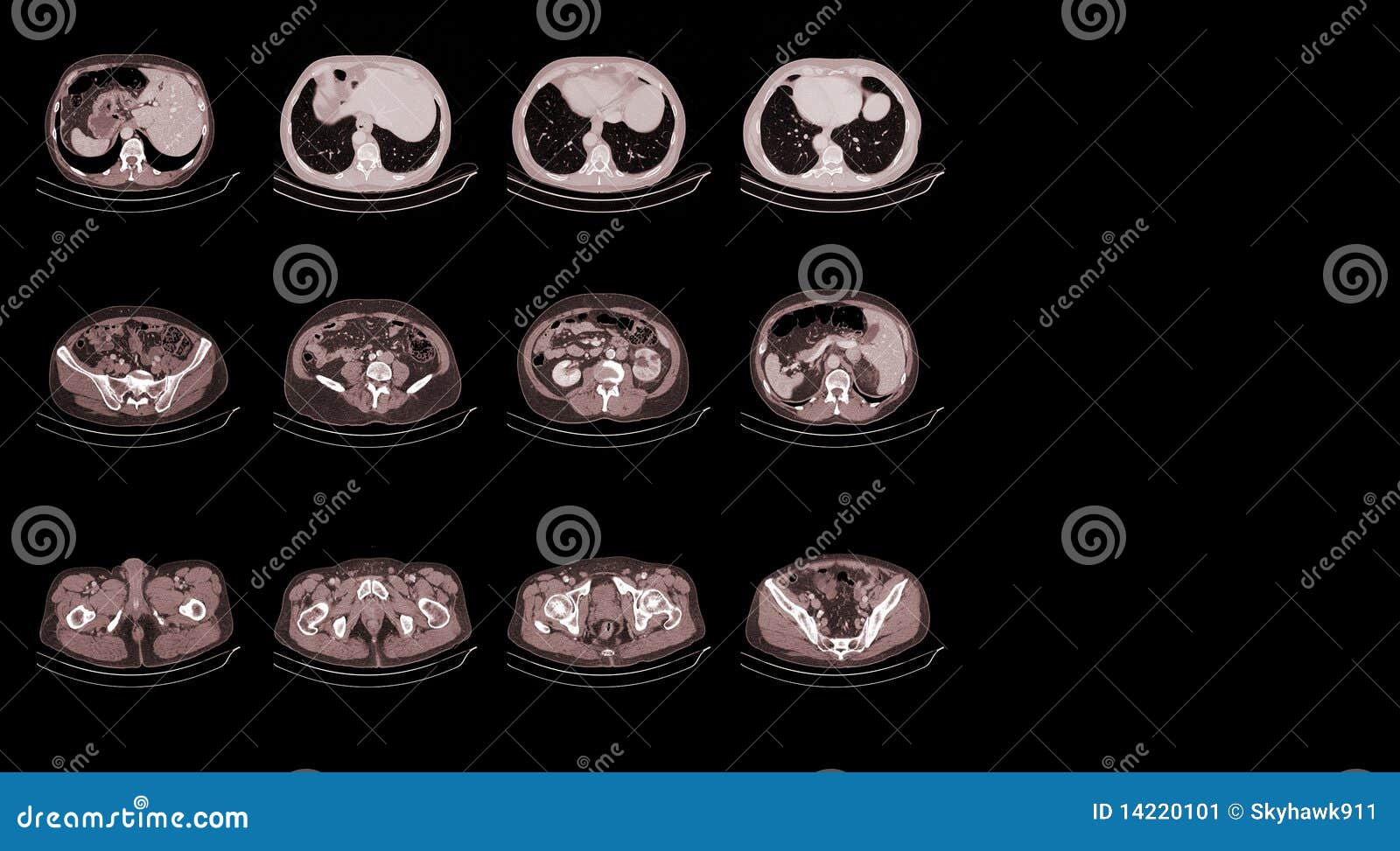 Ct scan of a old man stock image. Image of people, brain - 14220101