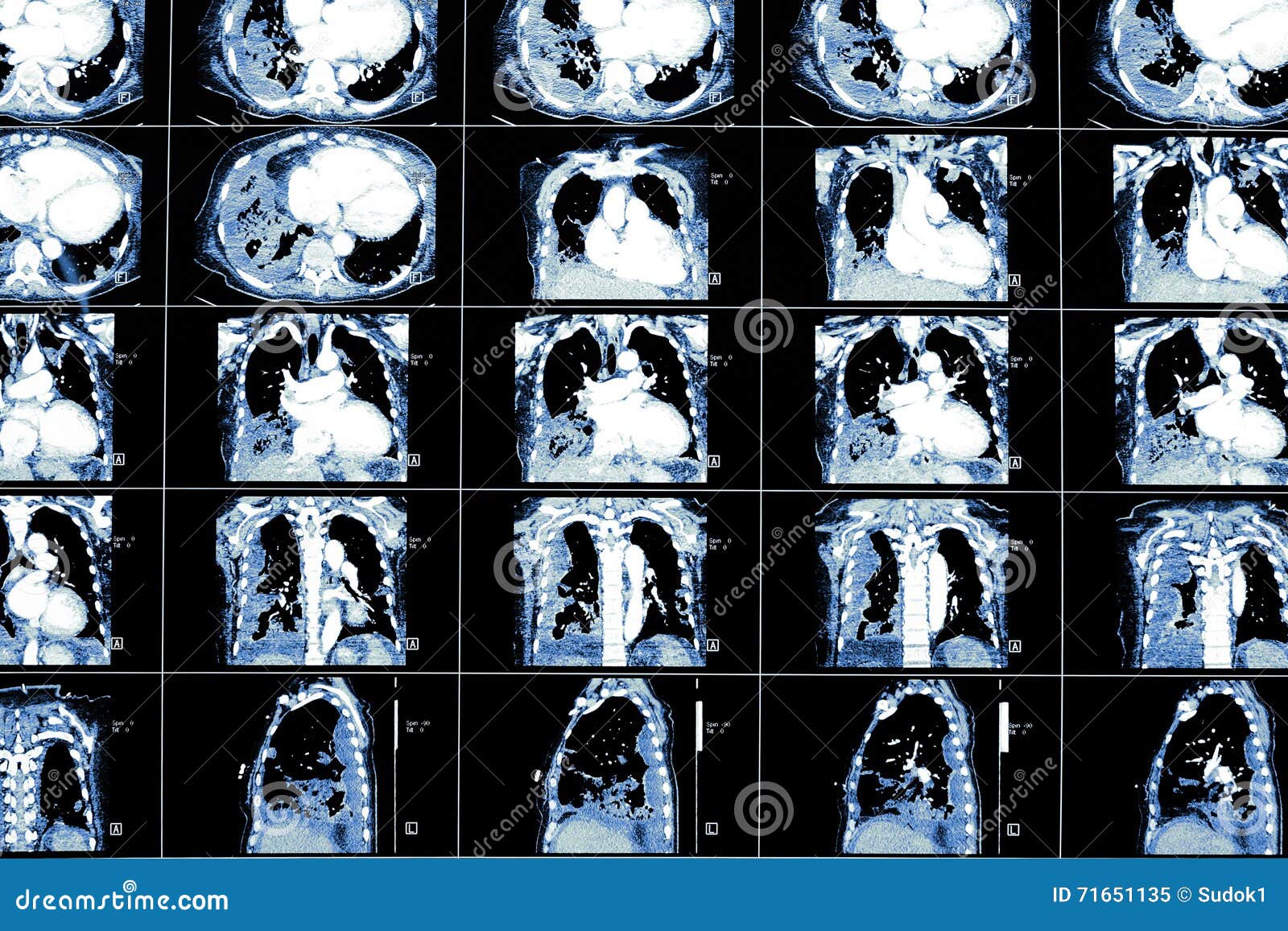 CT Scan of Patient Background Stock Image - Image of health, diagnosis ...