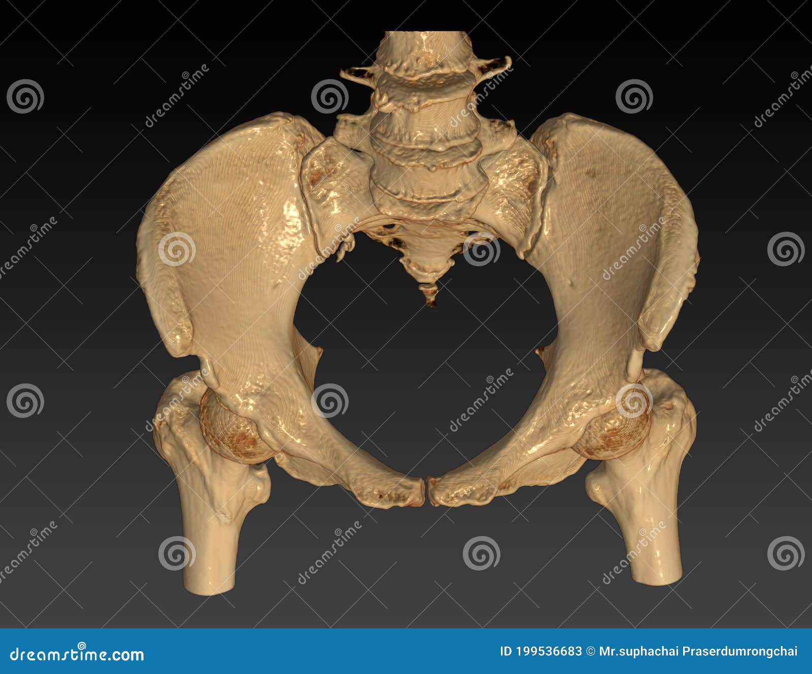 CT Scan Of Pelvic Bone With Both Hip Joint 3D Rendering Image Outlet ...
