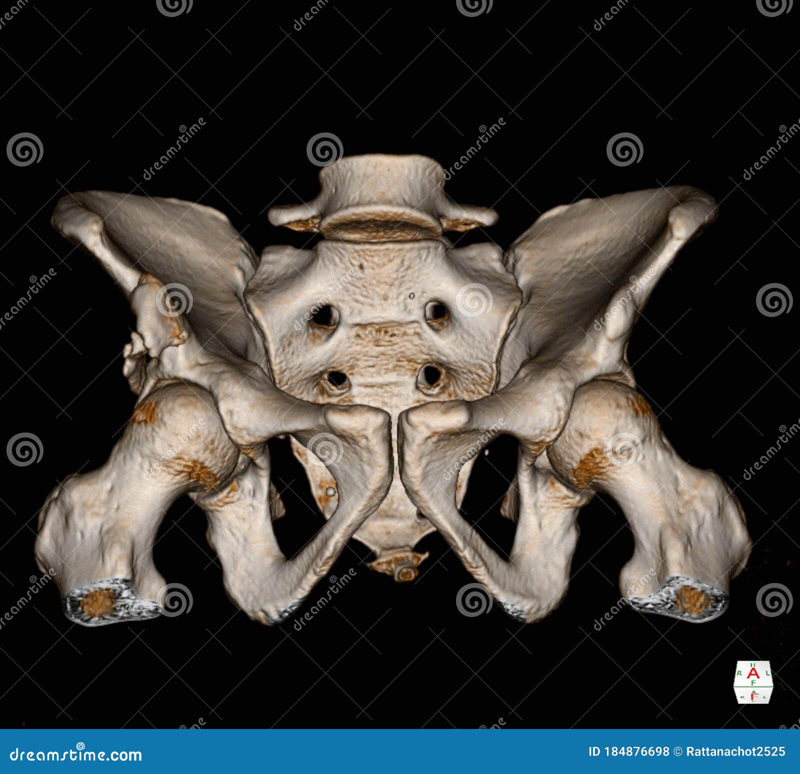 CT Scan Pelvis Bone 3D Rendering Image Isolated On Black Background ... CT Scan Pelvis Bone 3D Rendering Image Isolated On Black Background ...