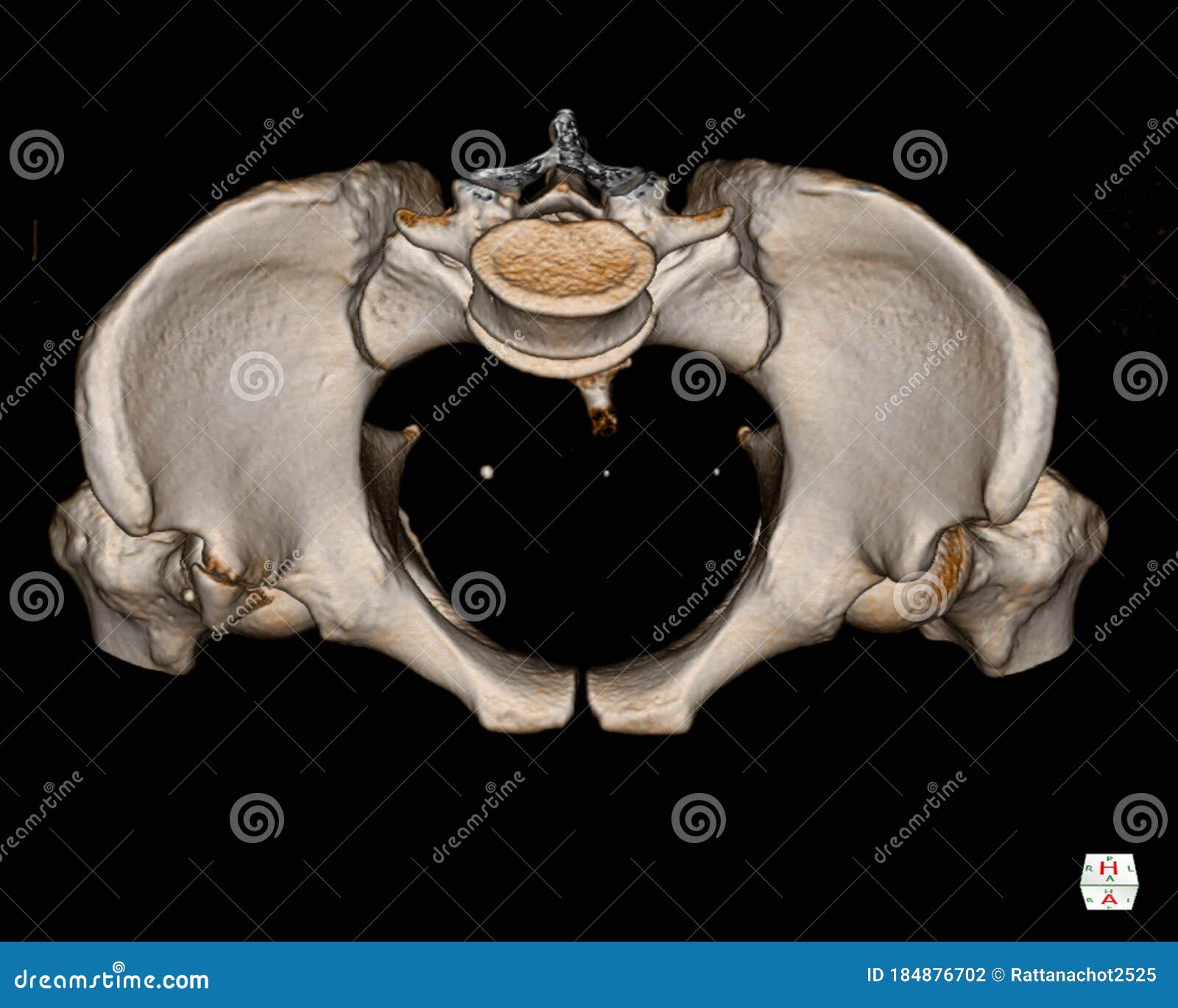CT Scan Pelvis Bone 3D Rendering Image Isolated On Black Background ... CT Scan Pelvis Bone 3D Rendering Image Isolated On Black Background ...