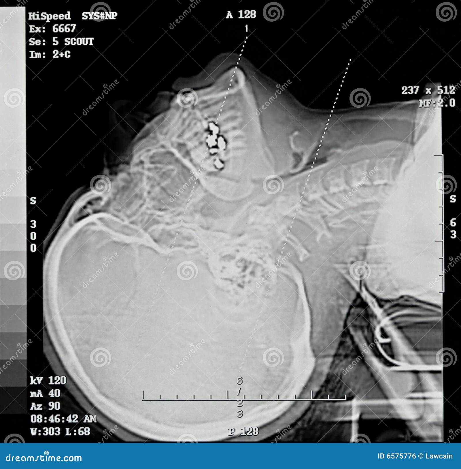 CT Scan Scout 5 stock photo. Image of brain, isolated - 6575776