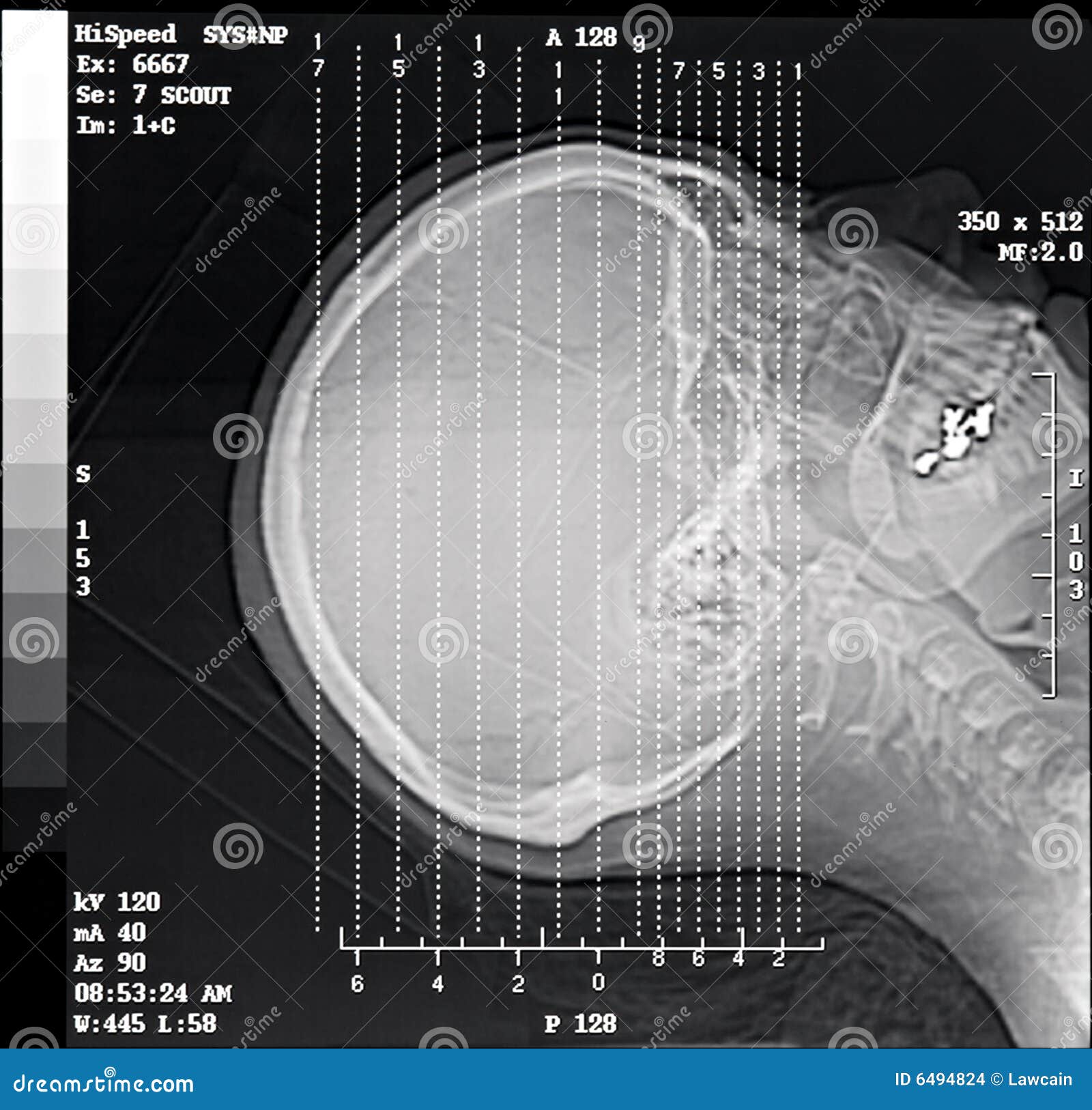 CT Scan Scout 7 Stock Images - Image: 6494824