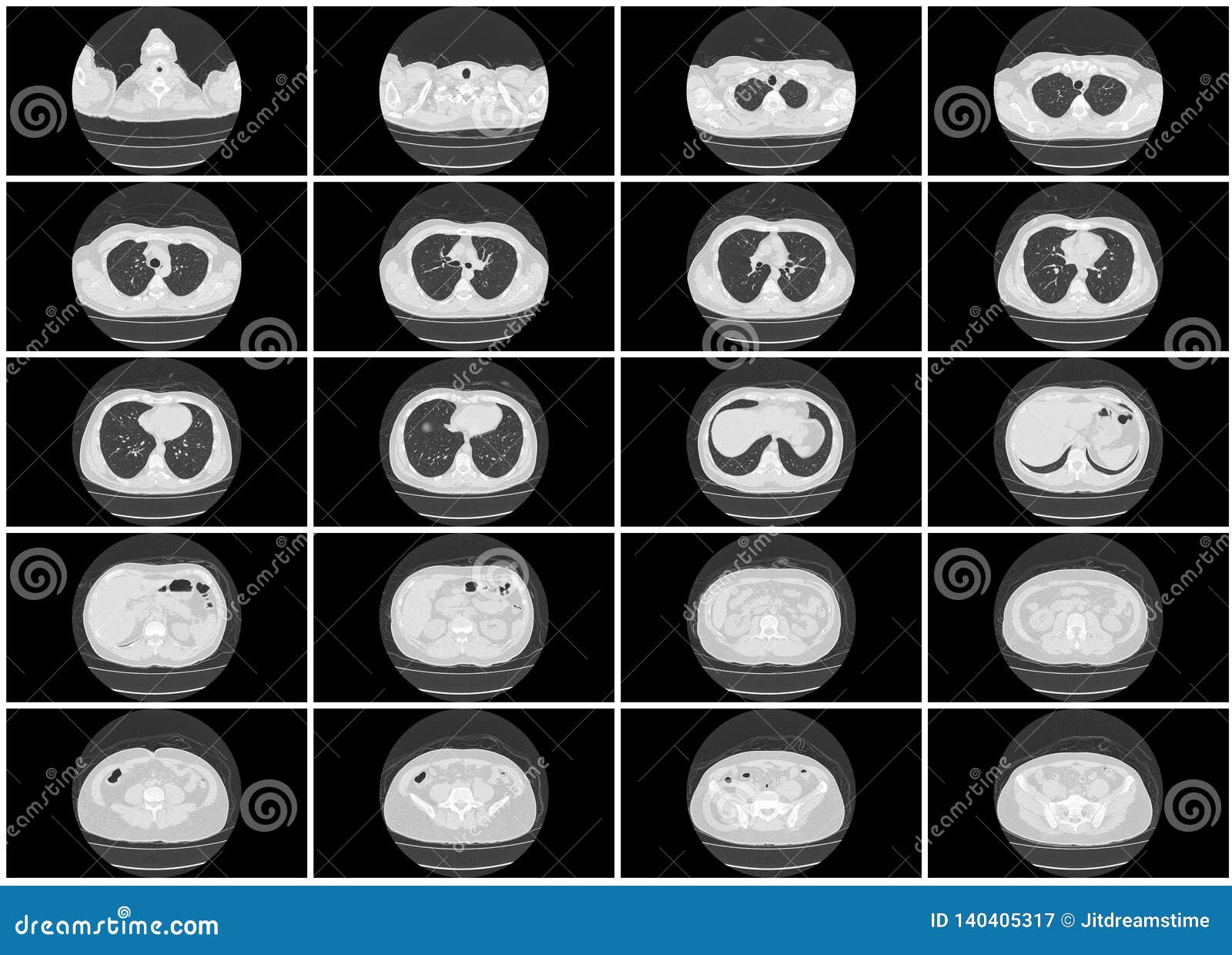 Ct Scan Step Set Of Upper Body Lung Axial Top View Stock Image Image Of Film Digital 140405317