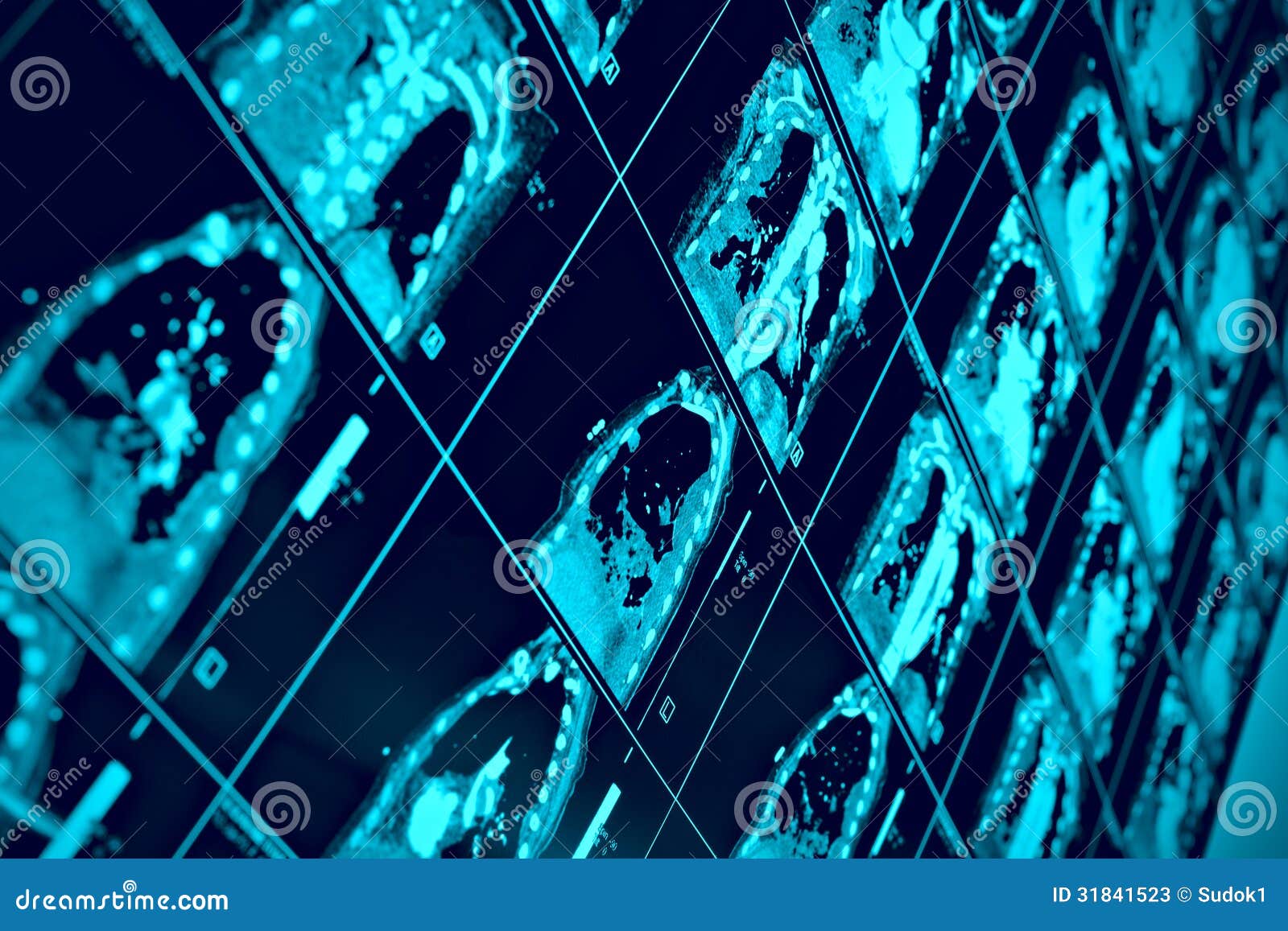 CT Scan Of Thoracic Segment. Scientific Background Royalty-Free Stock ...