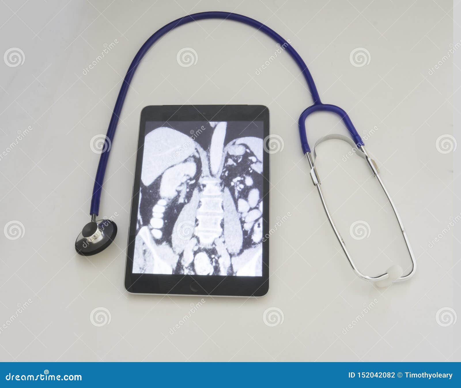 Ct Scan To Perform and Evaluate a Patient Status and Create a Diagnosis ...