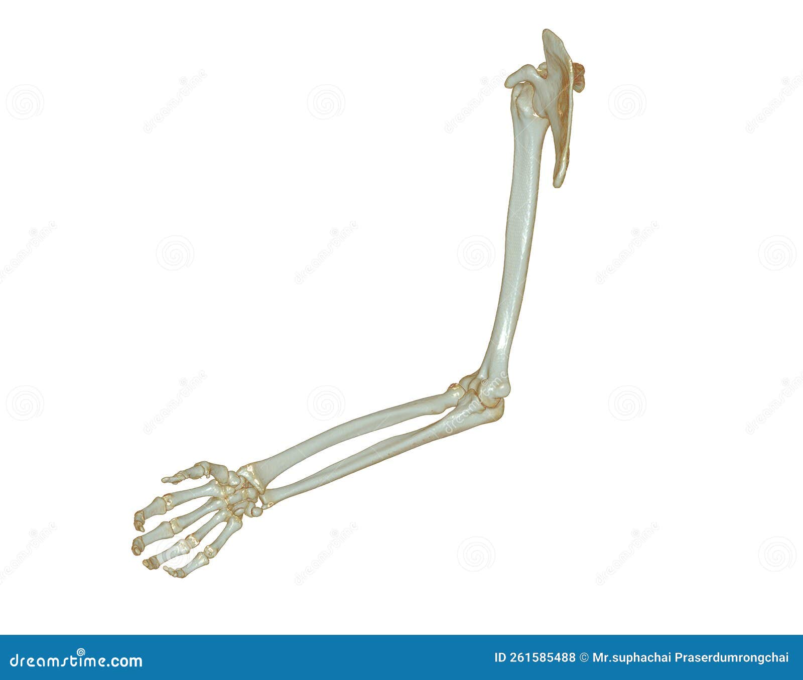 CT SCAN Of Upper Extremity 3D Rendering Isolated On White Background ...
