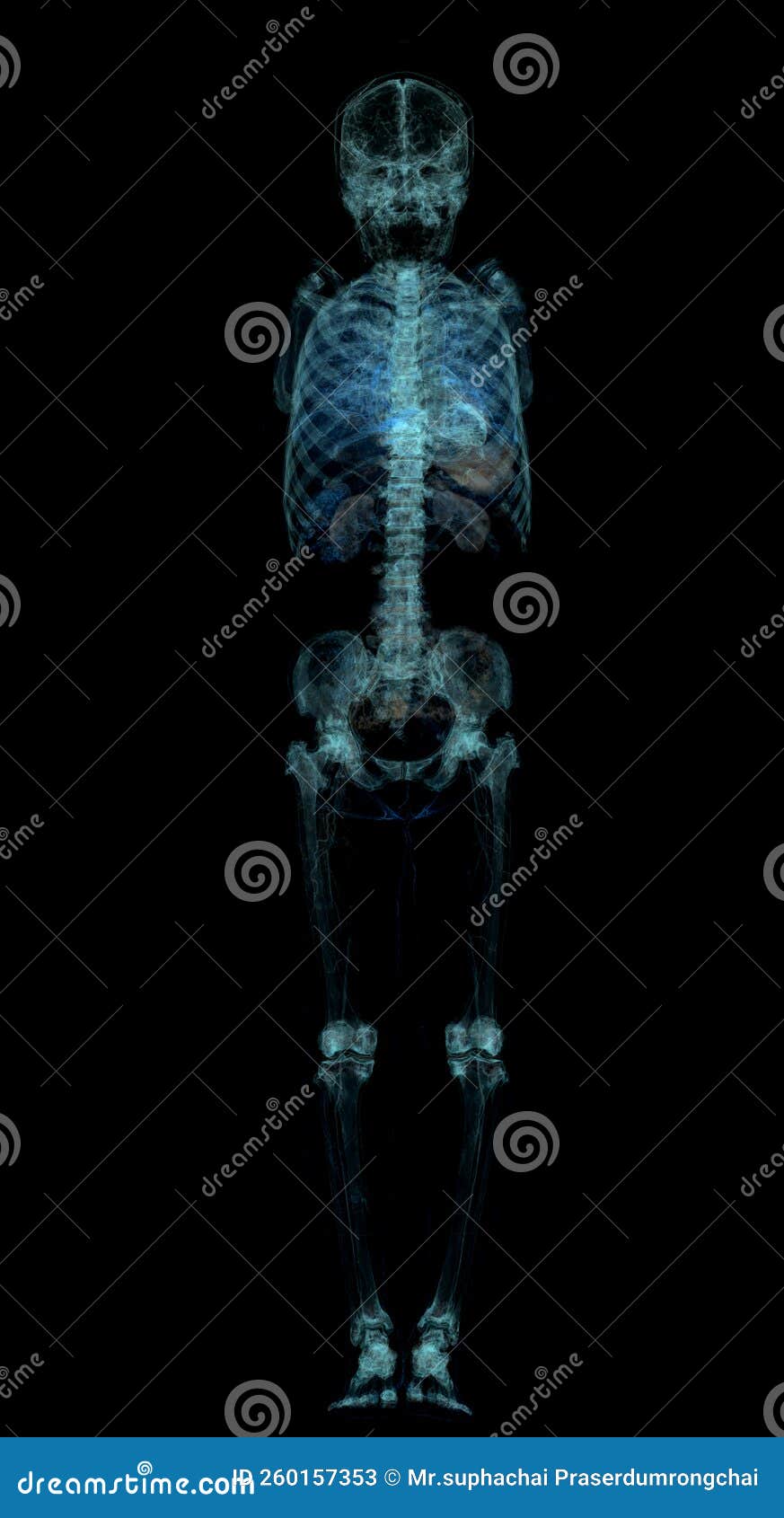 CT Scan Of Whole Spine 3D Rendering Showing Profile Human Spine Royalty ...
