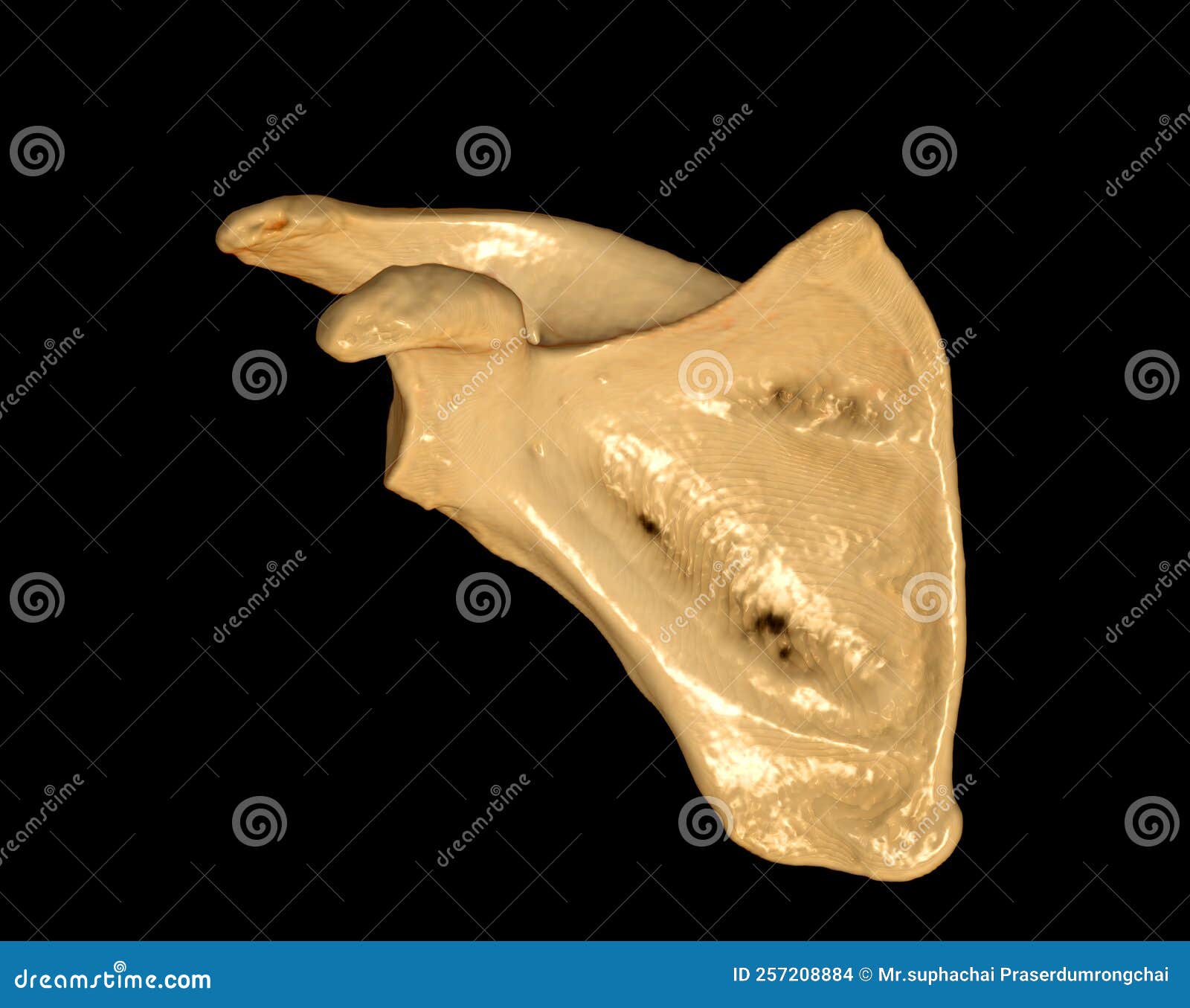 Radiograph Of The Shoulder Anatomy With Clavicle, Scapula, And Humerus ...