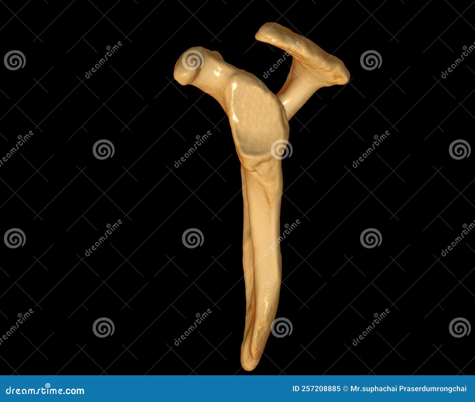 Radiograph Of The Shoulder Anatomy With Clavicle, Scapula, And Humerus ...