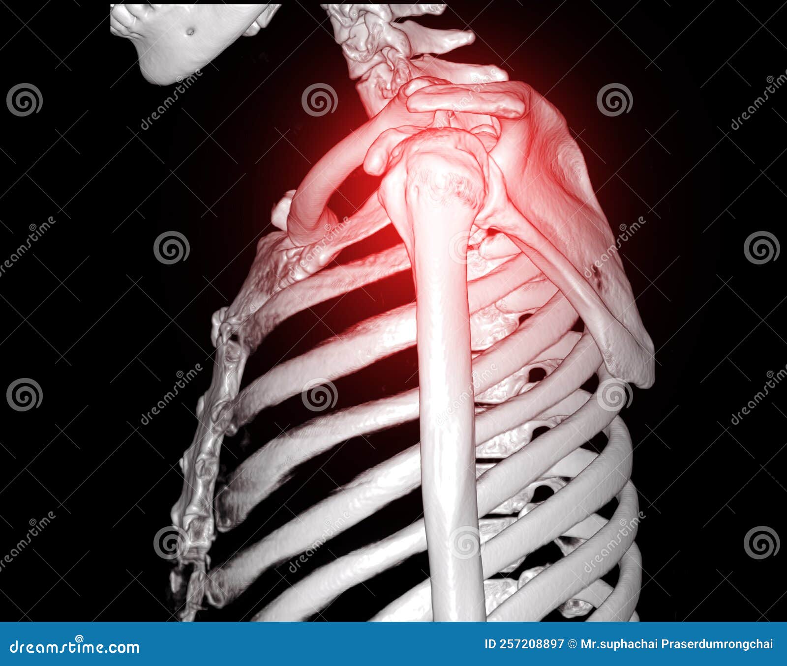 CT Shoulder 3D stock illustration. Illustration of examination - 257208897
