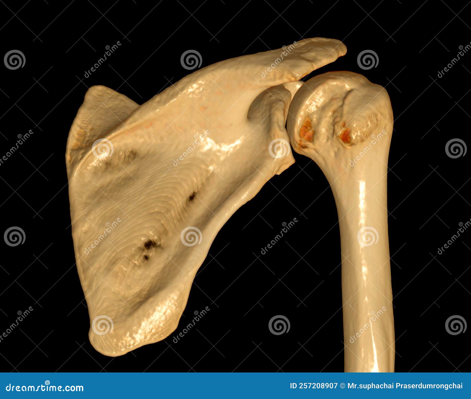 CT Shoulder 3D stock illustration. Illustration of shoulder - 257208907