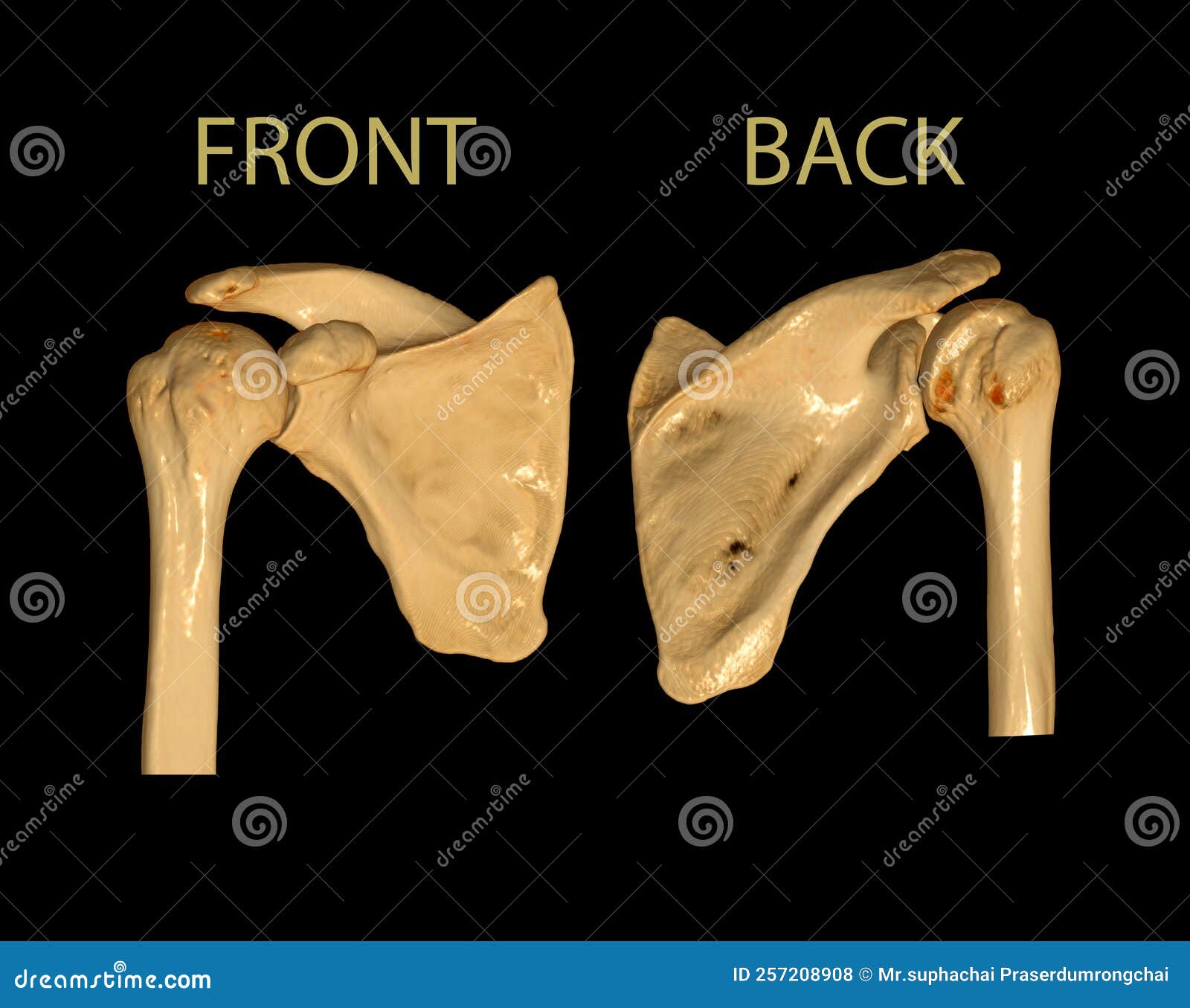 Radiograph Of The Shoulder Anatomy With Clavicle, Scapula, And Humerus ...