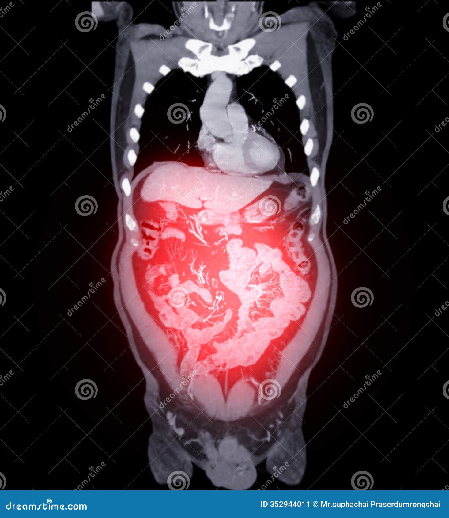 Comprehensive CT Scan Of The Knee Joint Detailed Anatomy And Cartilage ...