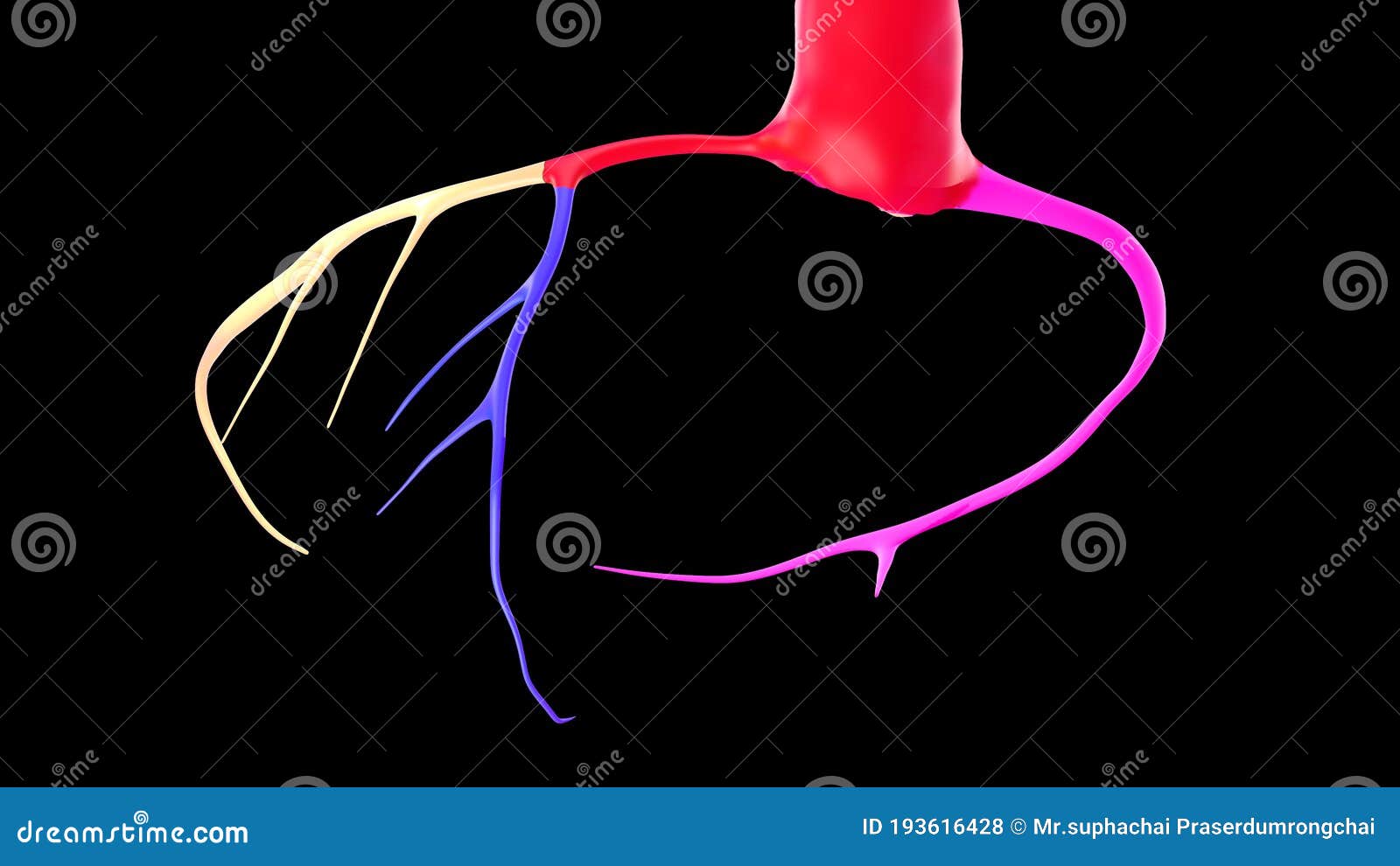 CTA Coronary Artery 3D Rendering 7.2020 Stock Illustration ...