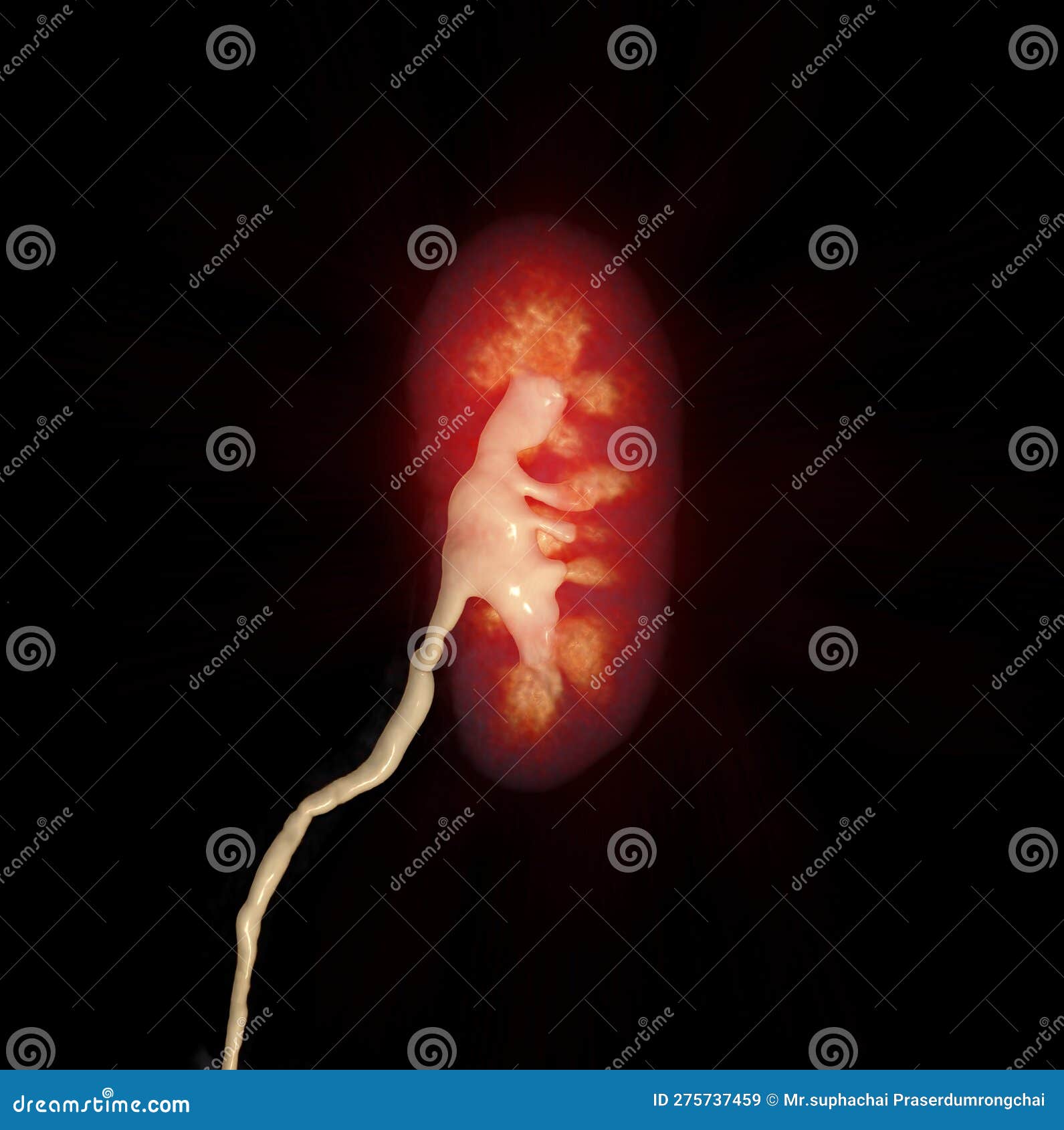 CTA Renal Artery Showing Kidney 3D Rendering Image Stock Illustration ...