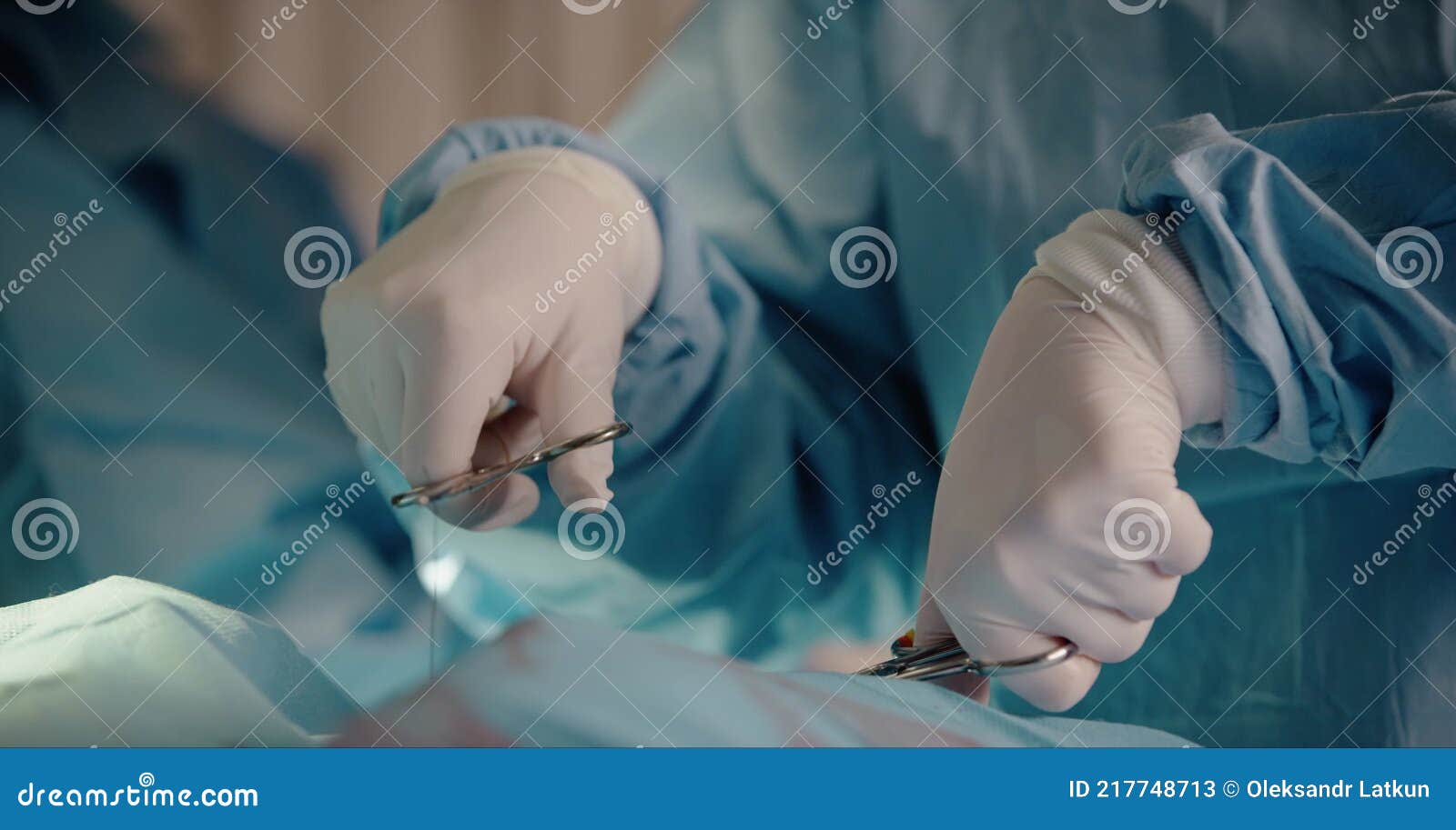 CU Cutting Suture in Surgery. High Quality Stock Video - Video of ...