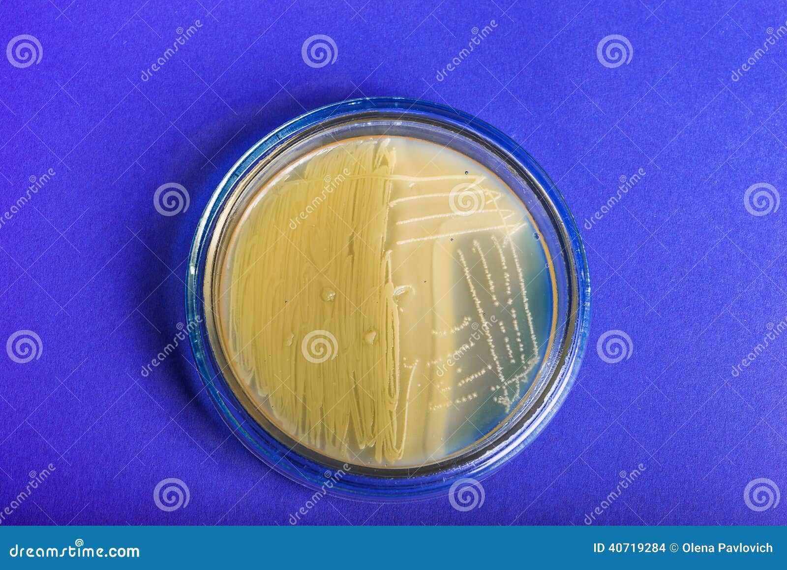 Cultivation of Bacteria on Agar in Sterile Box. Stock Photo - Image of ...