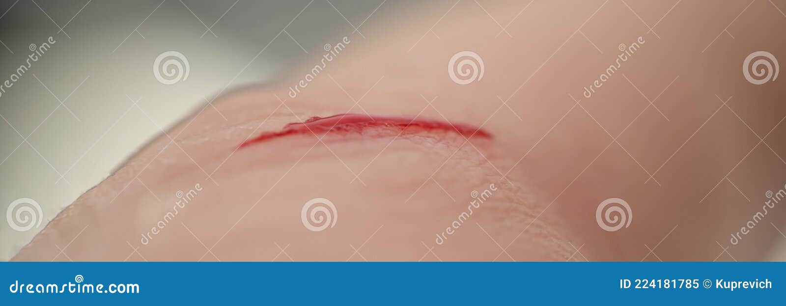 Cut with Blood on the Skin Closeup Stock Image - Image of blood ...