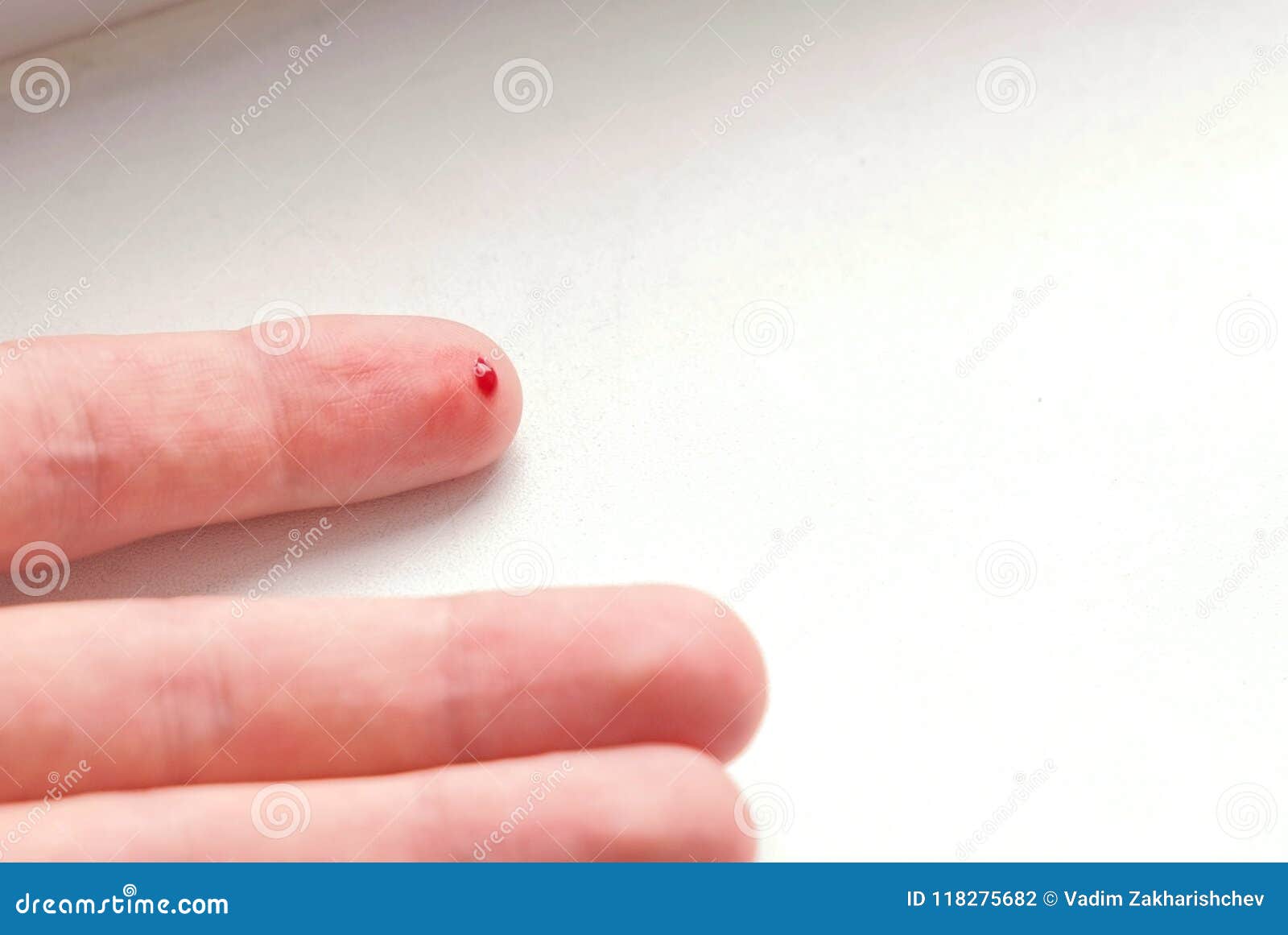 Cut on the Finger of a Man`s Hand. Blood Flows. Stock Photo - Image of ...