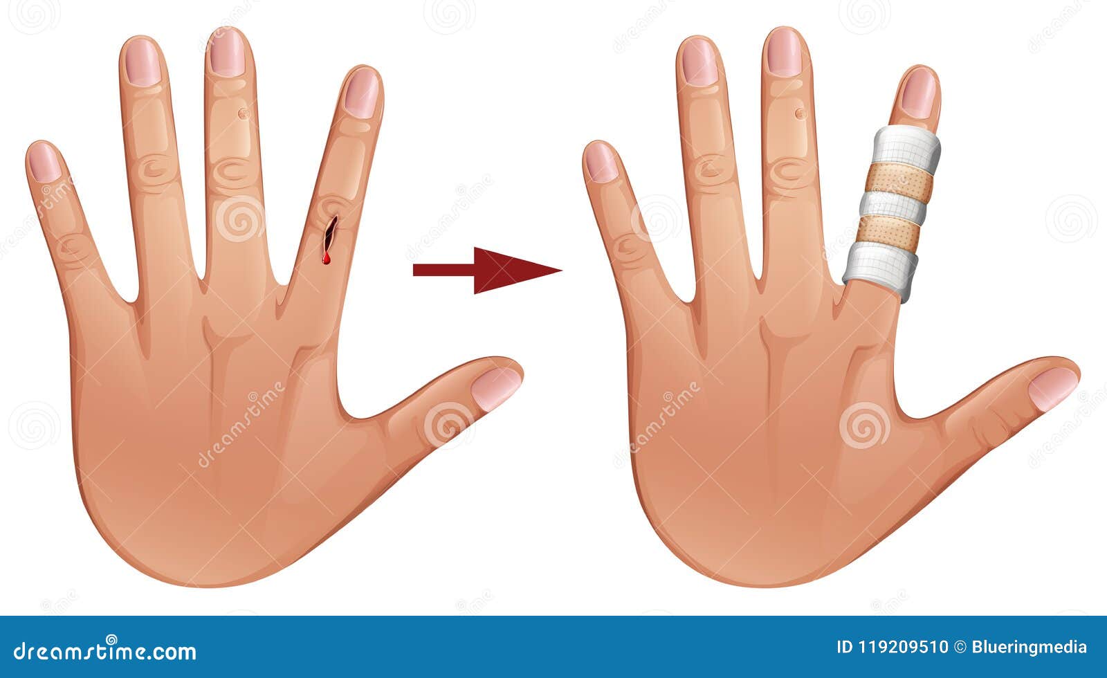 Bandage Cartoons, Illustrations & Vector Stock Images - 14945 Pictures ...