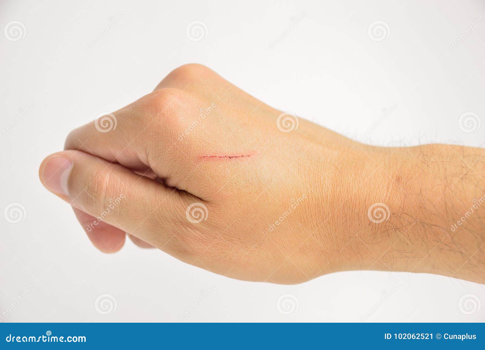 With a cut hand stock image. Image of homicide, accident - 102062521