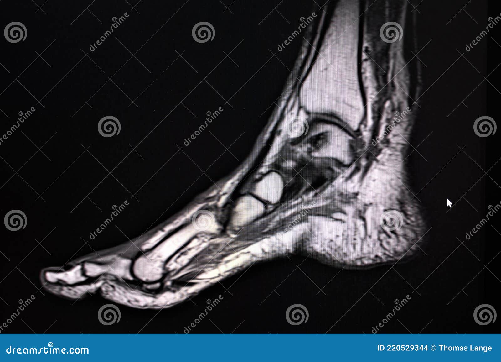 Cut through a Human Foot - MRT Image Stock Photo - Image of diagnostics ...