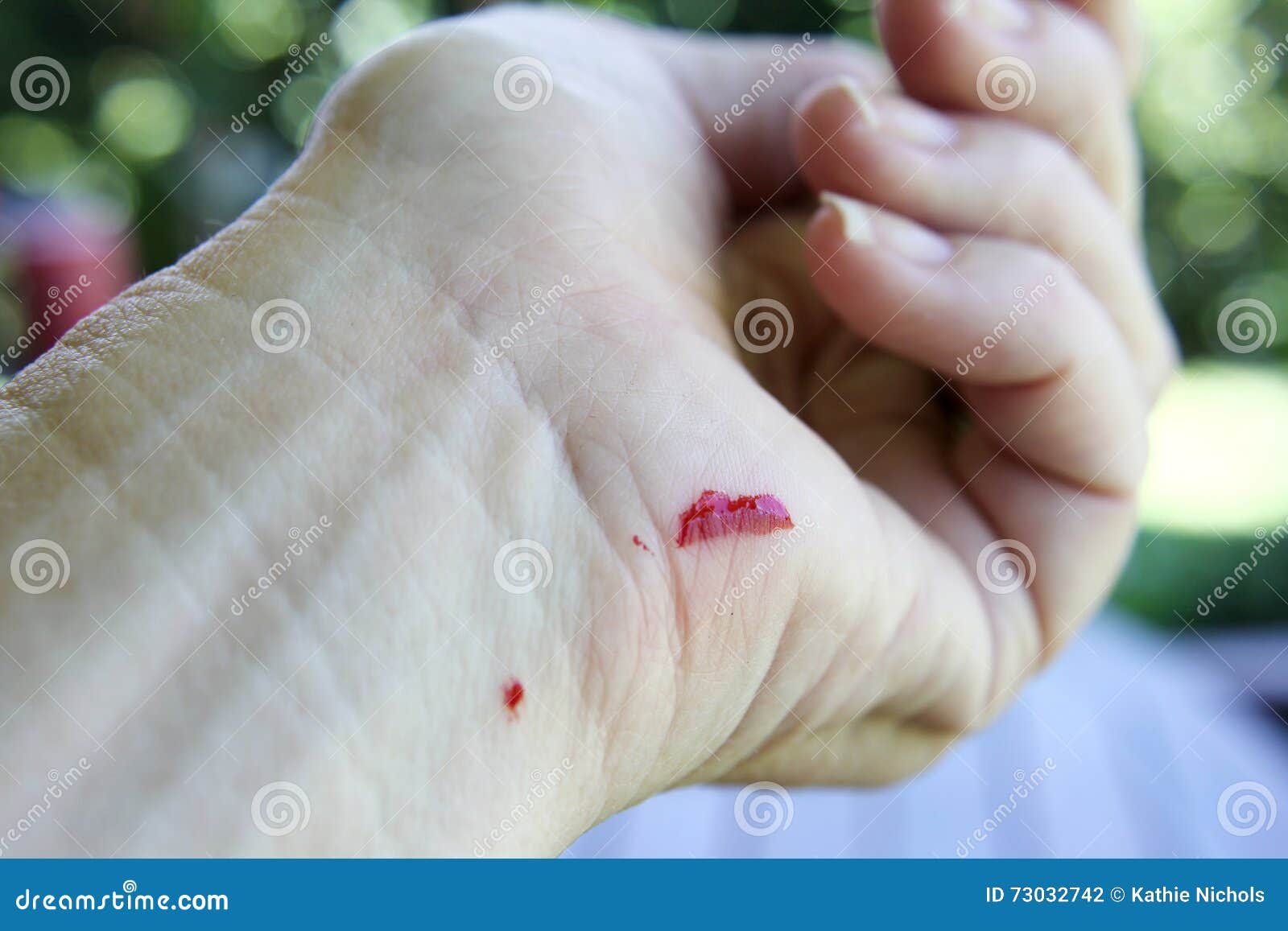 Cut on Womans Hand stock photo. Image of heal, medical - 73032742