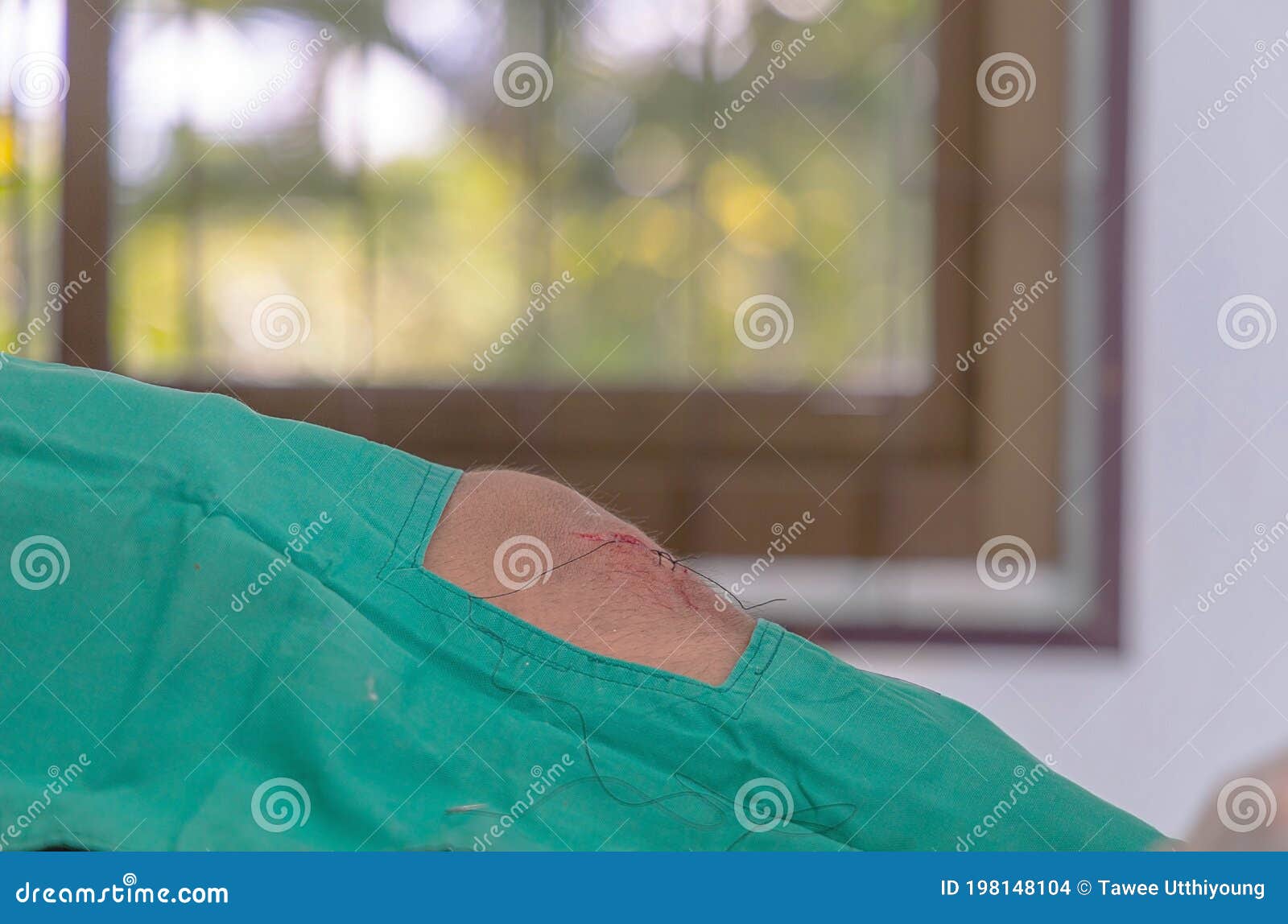 Cut wound dressing stock photo. Image of operation, dressing - 198148104