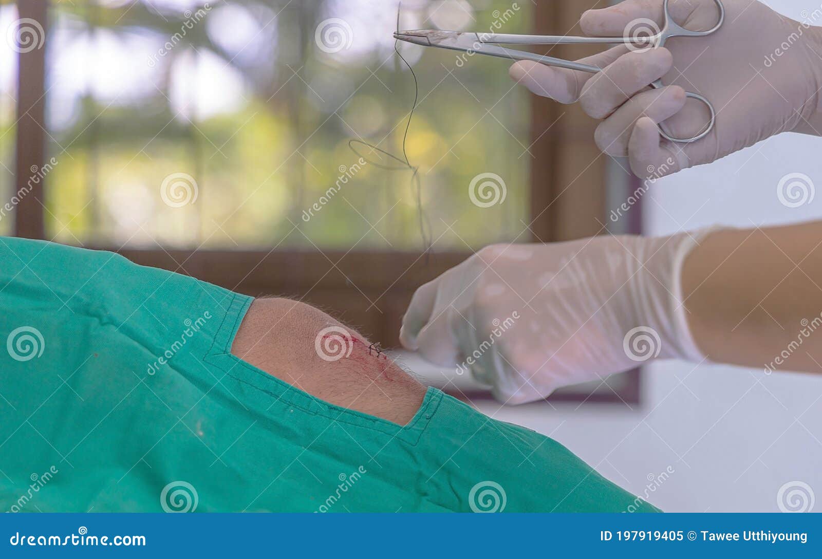 Cut Wound Dressing,cut Wound Surgering Stock Image - Image of injury ...