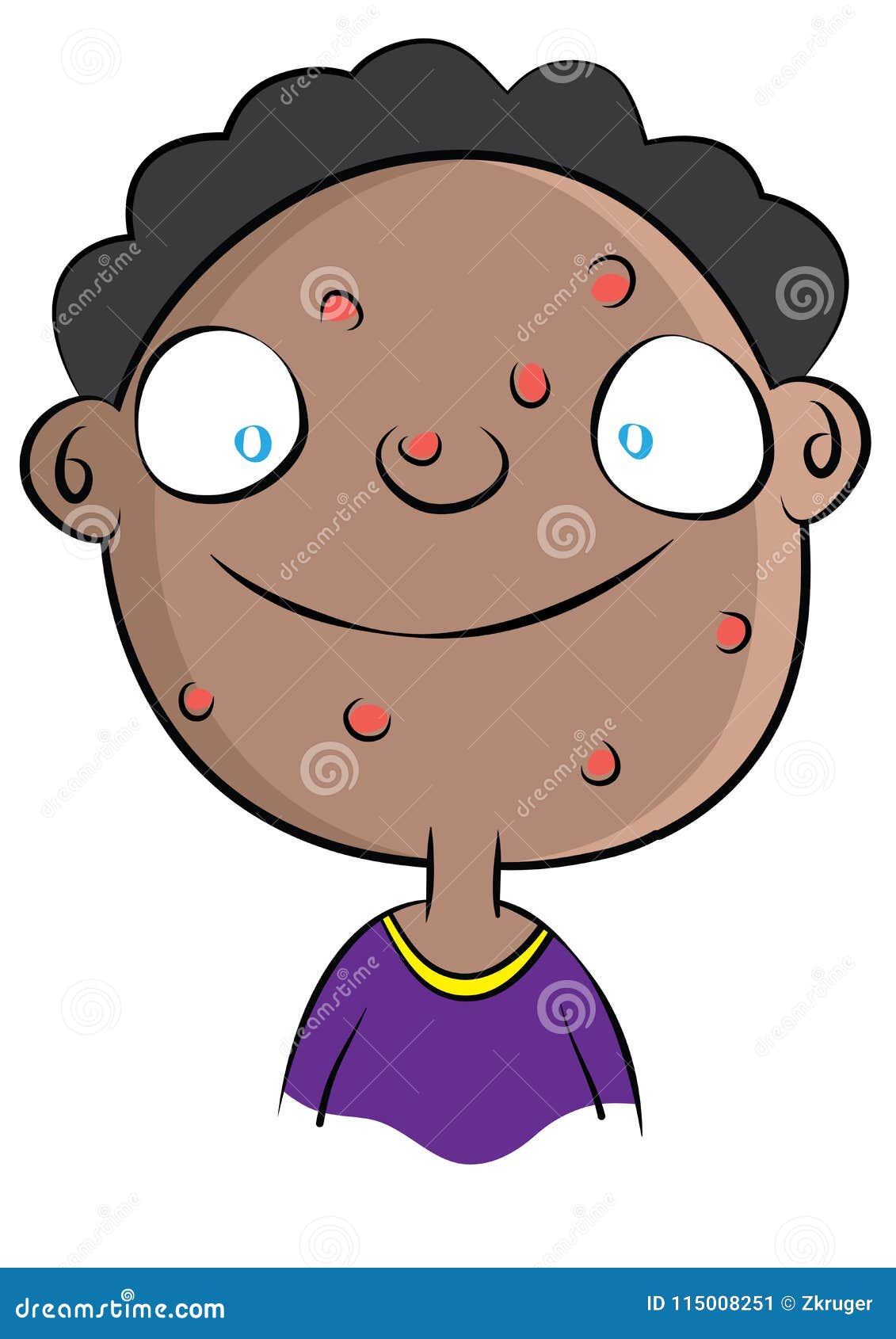 Cute Black Boy with Acne Problem Stock Vector - Illustration of black ...