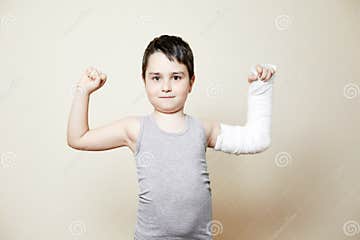 Cute boy with broken arm stock photo. Image of accident - 70908834