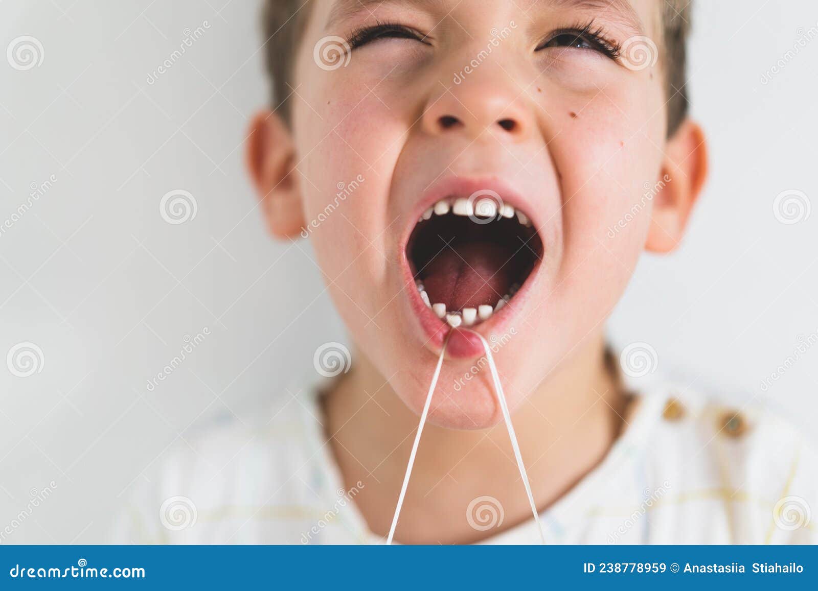 Cute Boy Pulling Loose Tooth Using a Dental Floss. Process of Removing ...