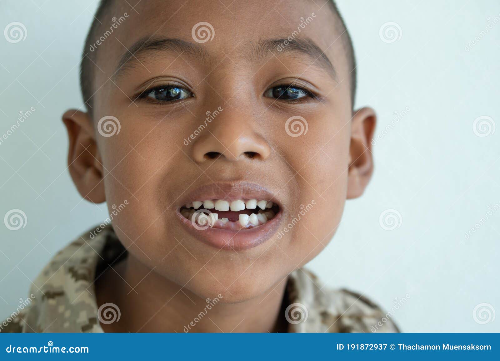 Cute Little Asian Boy Smile and Show Teeth Broken Stock Image - Image ...