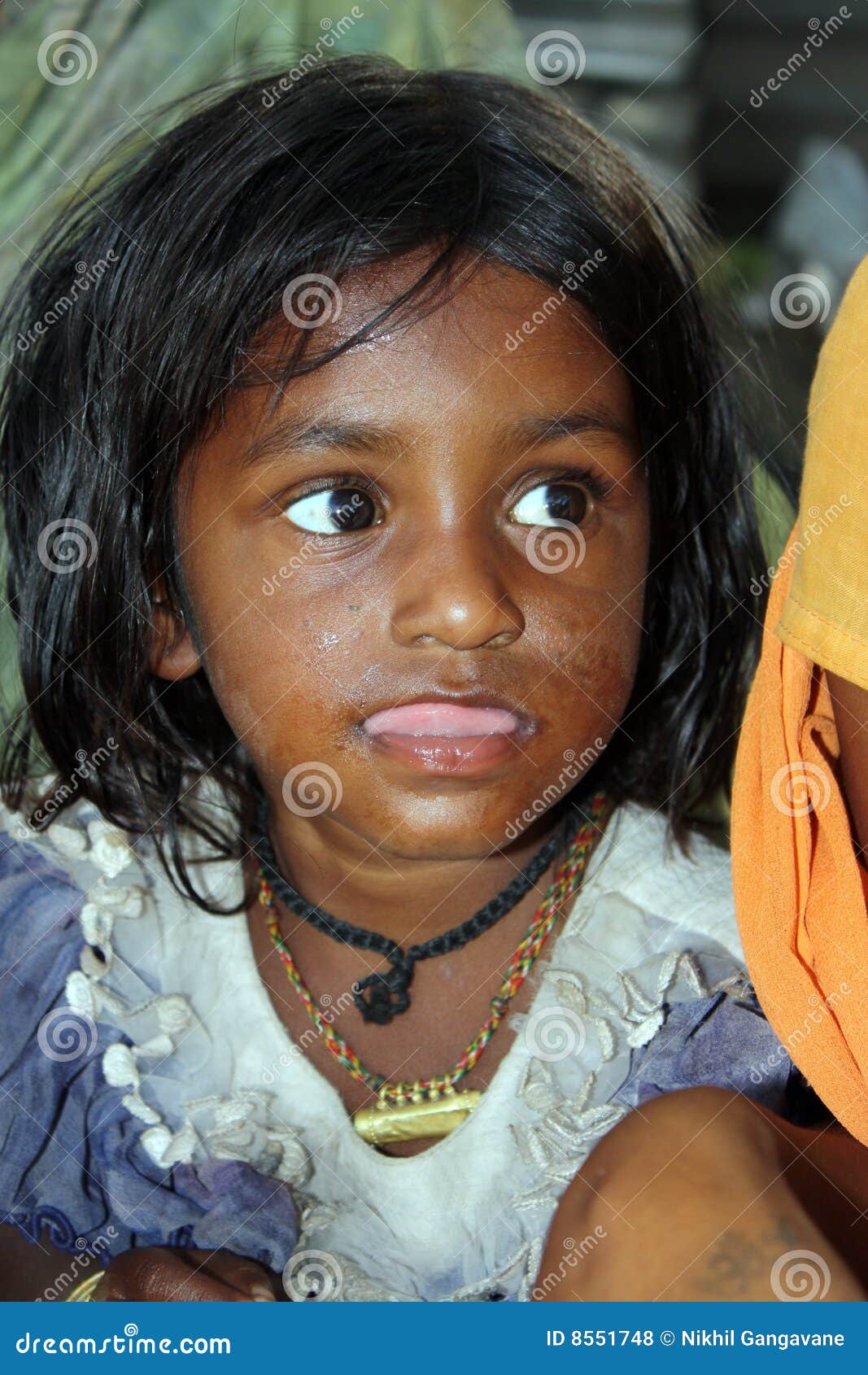 Cute Poor Girl stock photo. Image of orphans, asian, sick - 8551748