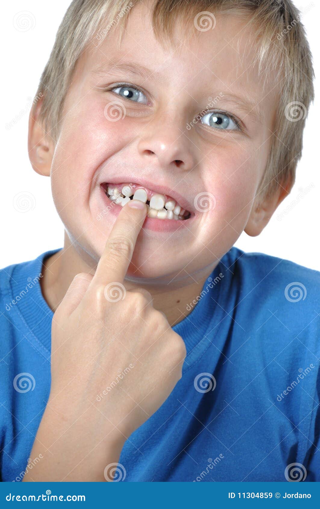 Cute toothless boy stock image. Image of childhood, good - 11304859