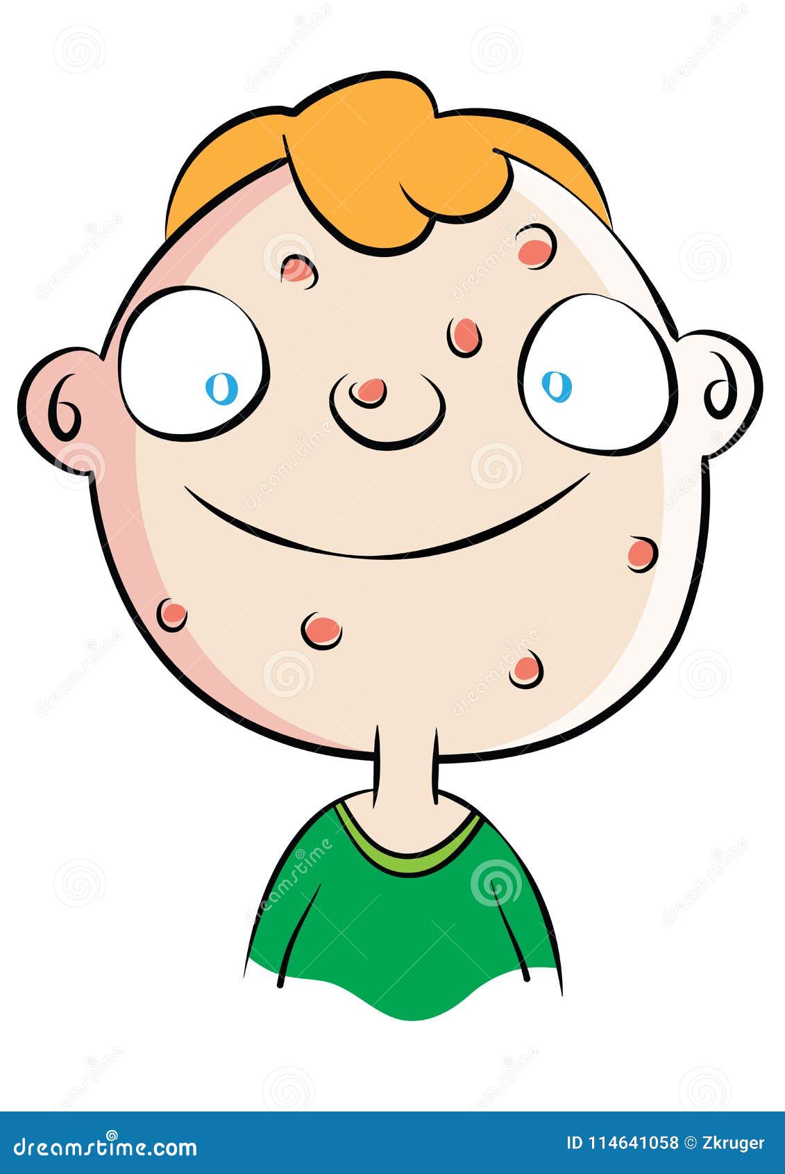 Funny Pimple Cartoon