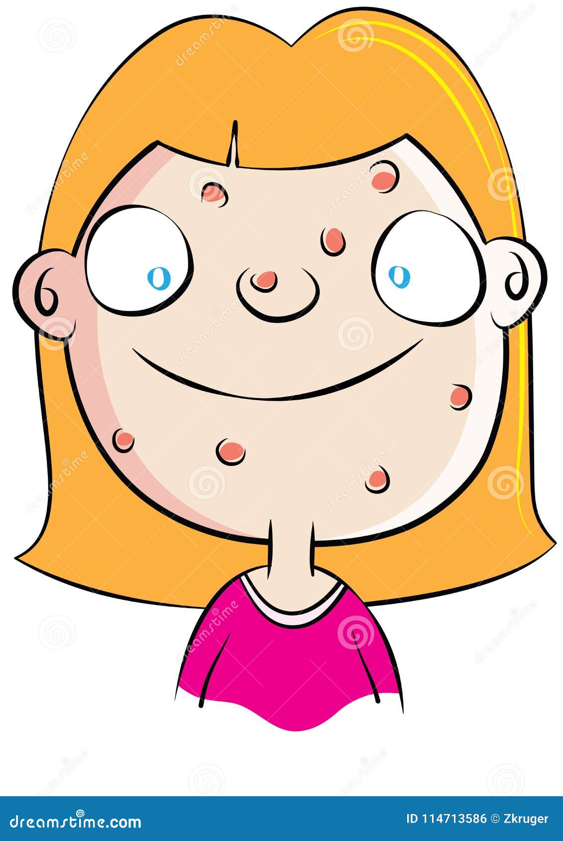 Cute White Girl With Acne Problem Stock Vector Illustration Of Color