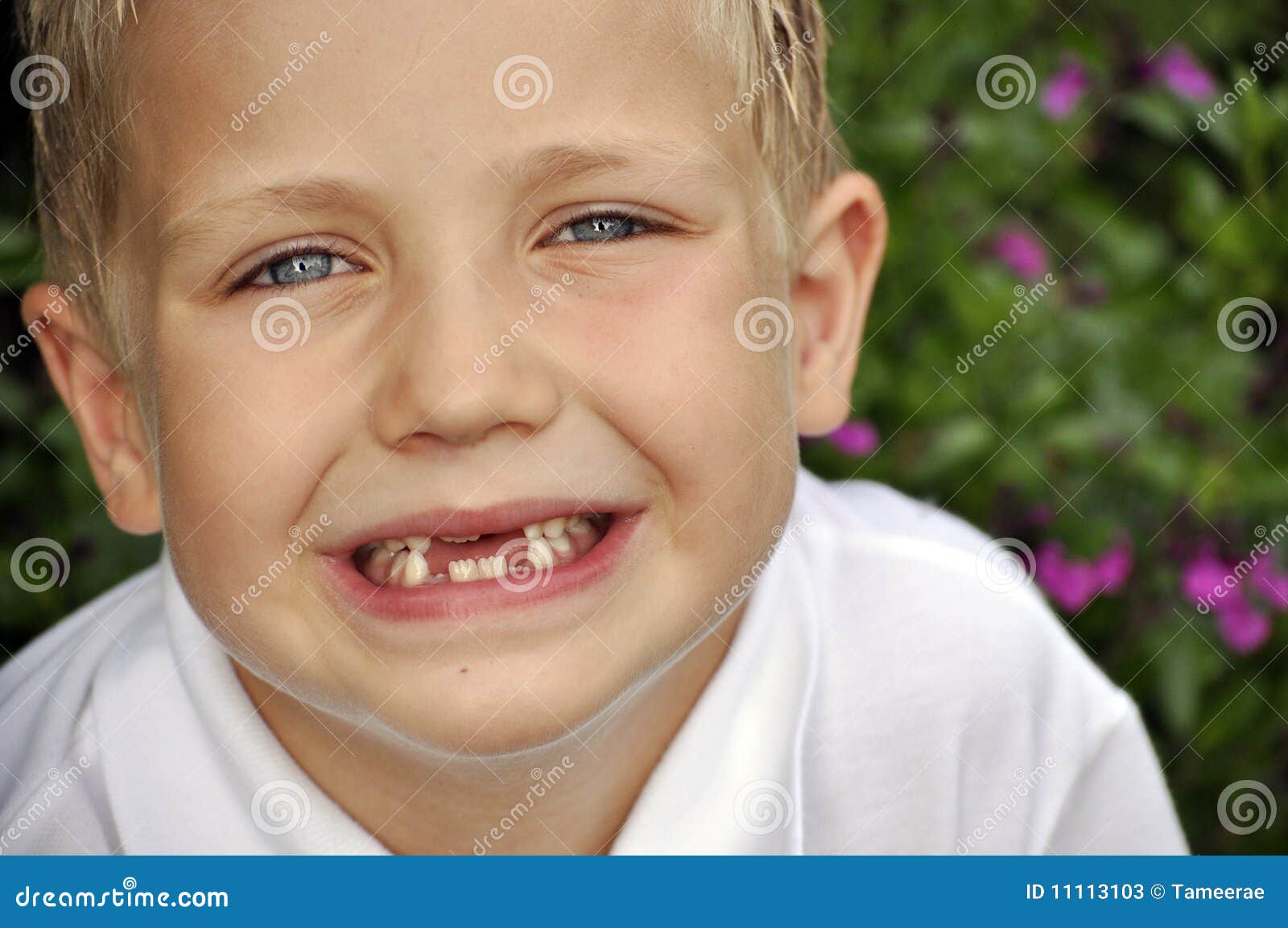 Cute Young Boy Showing His Teeth Stock Image - Image of close, smile ...