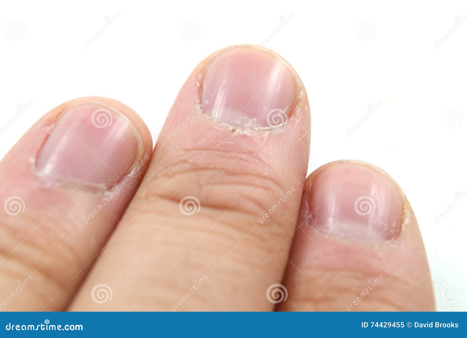 Cuticles macro stock image. Image of care, healthy, polish - 74429455